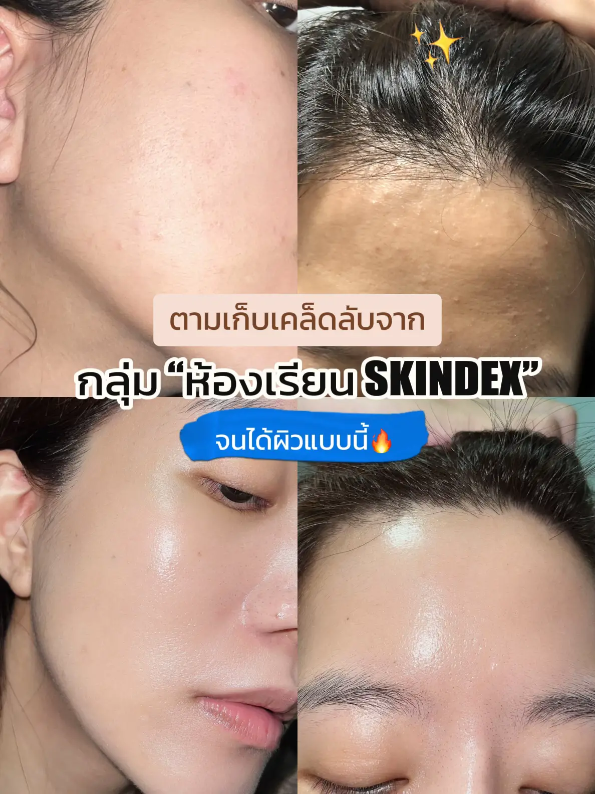 โฟมถ่านภูเขาไฟ - การค้นหาใน Lemon8