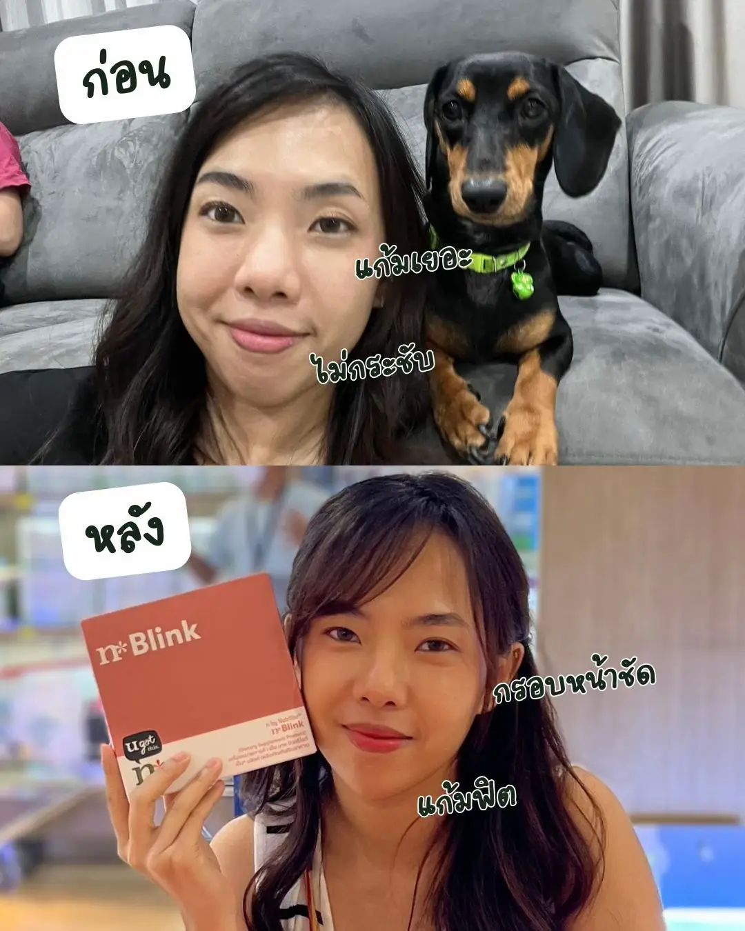 รีวิว Ultramax Hifu - การค้นหาใน Lemon8