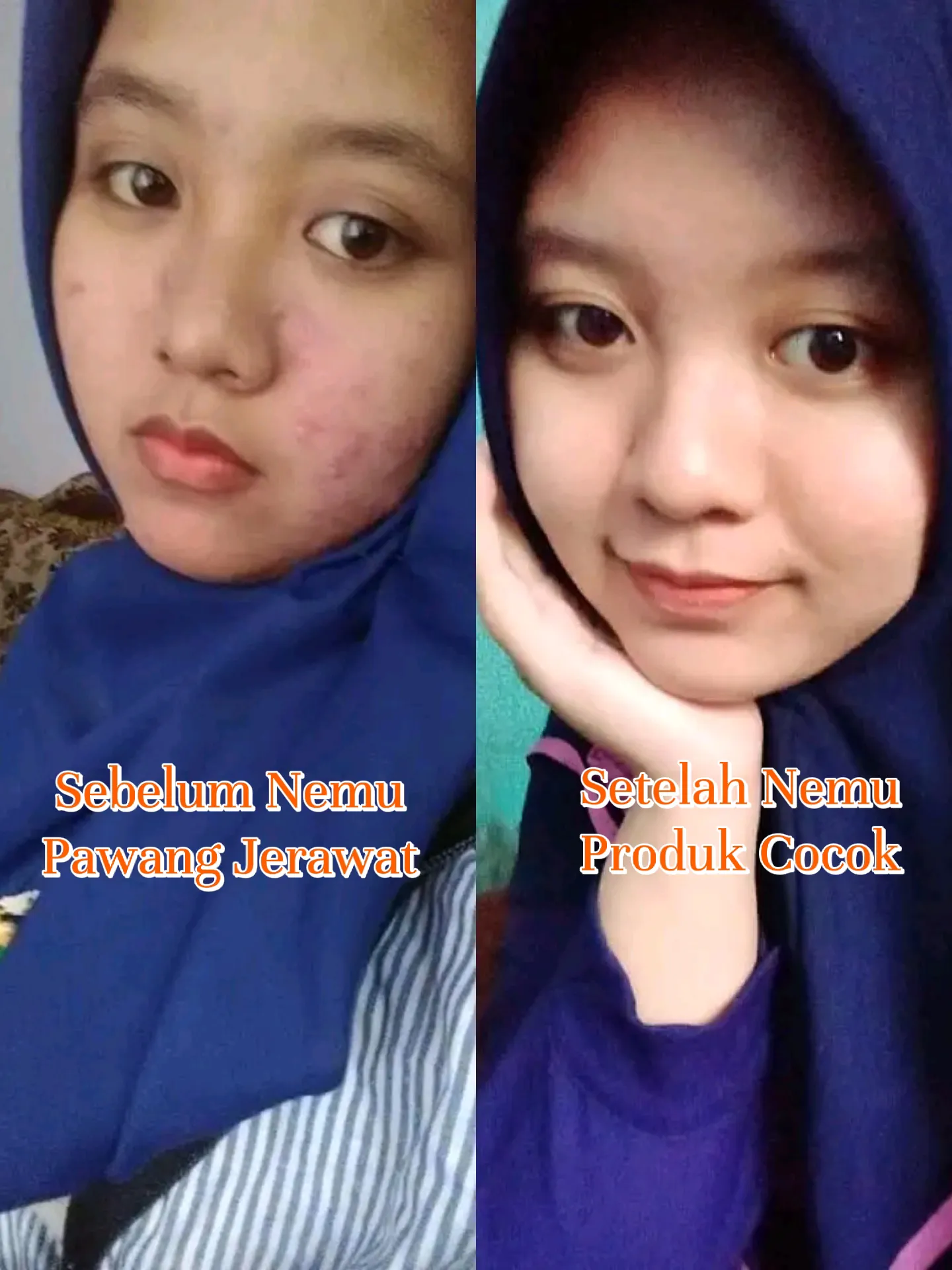Before After Nemuin Produk Penyelamat Wajah | Galeri diposting oleh ...