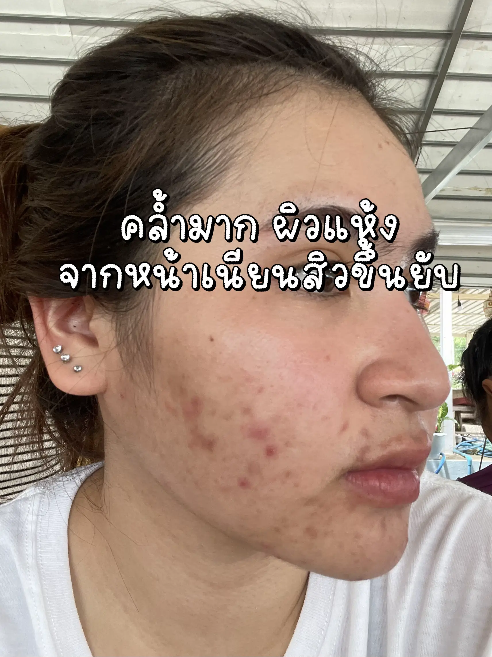 อย่าฝังอย่าคุมถ้าไม่อยาก… 😣 | แกลเลอรีที่โพสต์โดย Opy heart | Lemon8