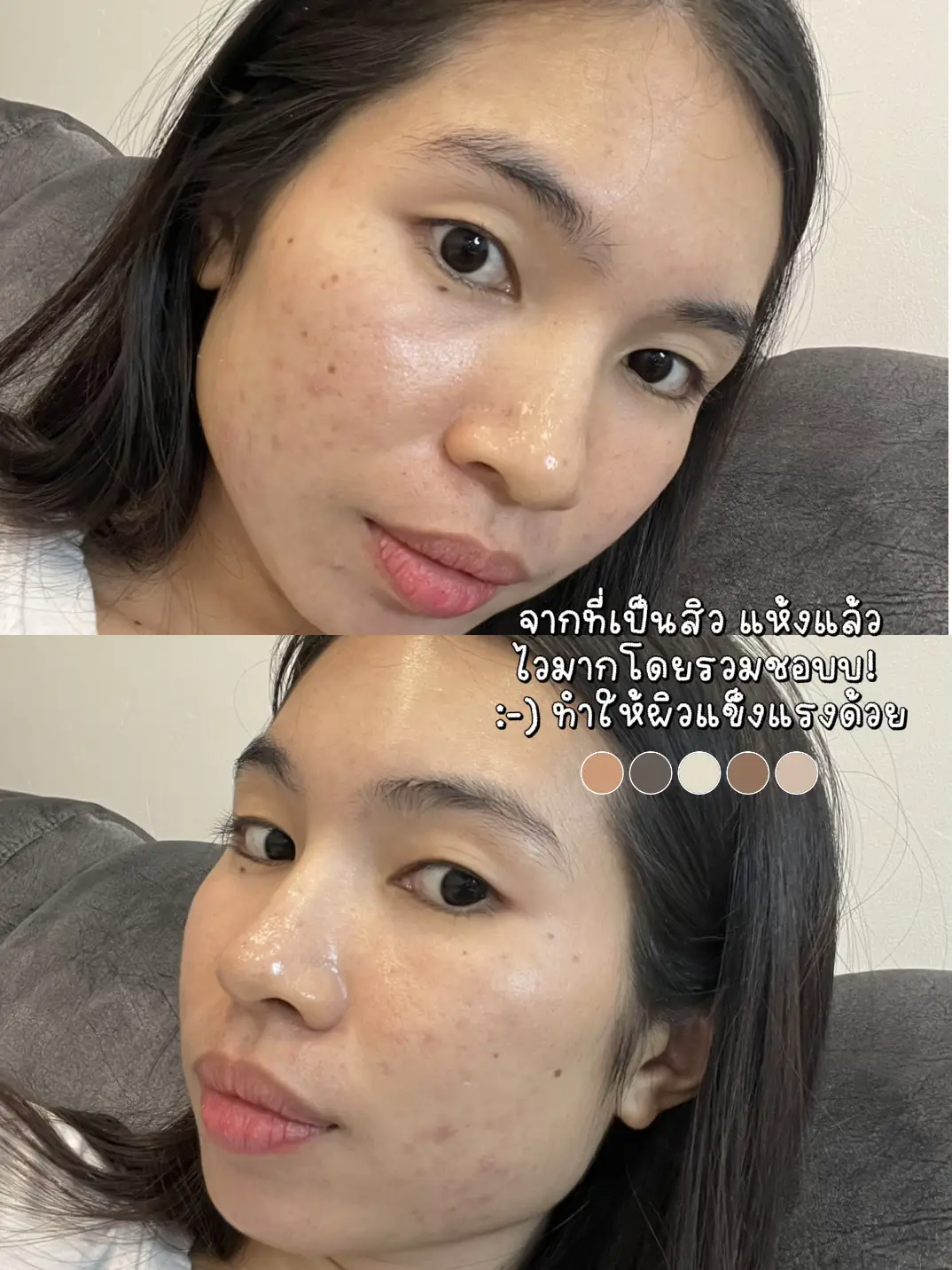 ลองใช้ CosMD ตามหมอเปาผลลัพธ์เป็นยังไง? | แกลเลอรีที่โพสต์โดย อิ๋งแบบอุ๋งอิ๋ง | Lemon8