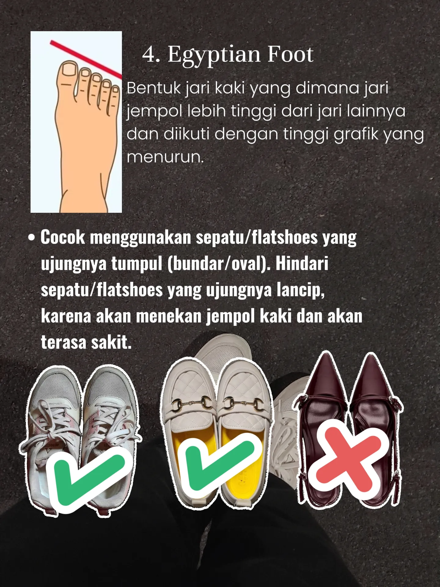 Jenis Sepatu Sesuai Bentuk Kaki, Kamu Yang Mana⁉ | Galeri diposting ...