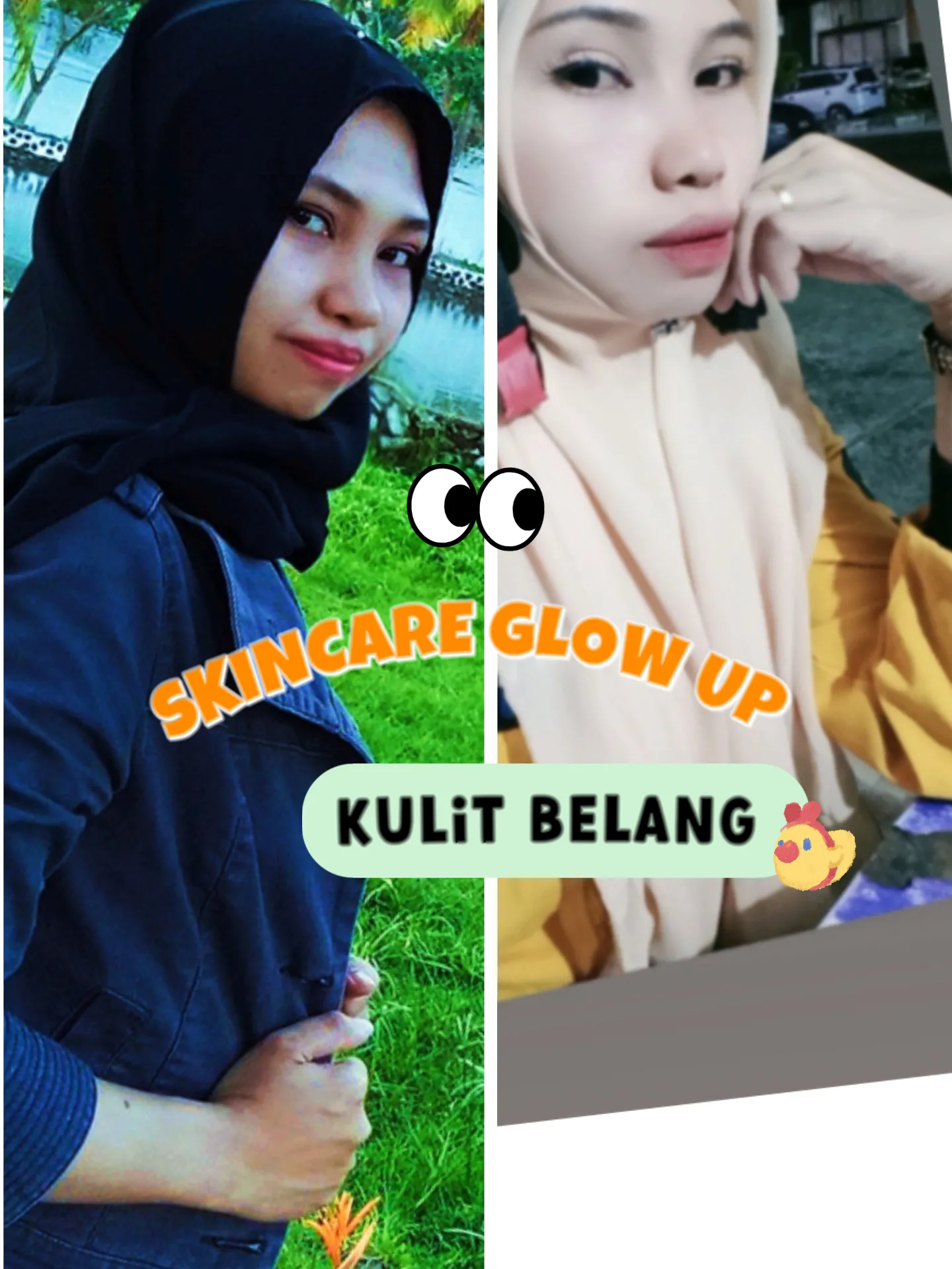KULT BELANG OTW GLOW UP | Galeri diposting oleh Ay Indah 🌼 | Lemon8