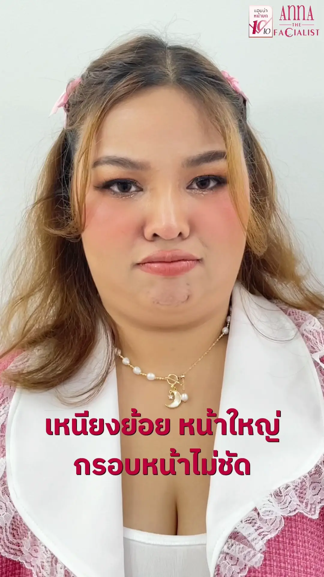 Triple Fat + โบท็อกซ์ลิฟหน้า | วิดีโอที่เผยแพร่โดย annaclinic | Lemon8