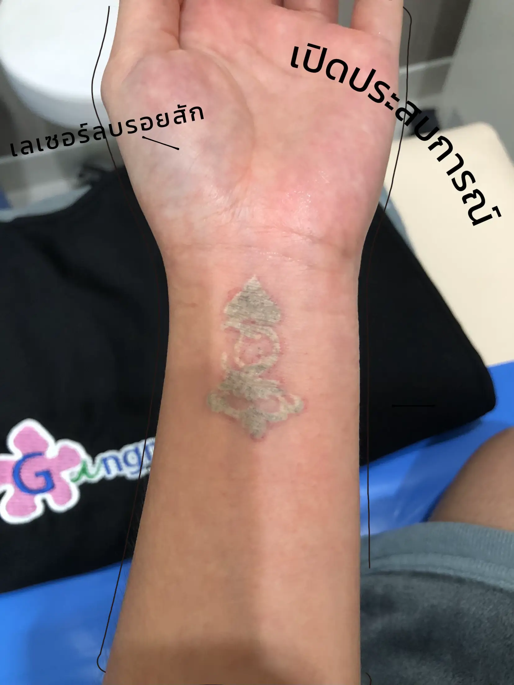 รีวิวกังนัมคลินิกสาขา Ics - การค้นหาใน Lemon8