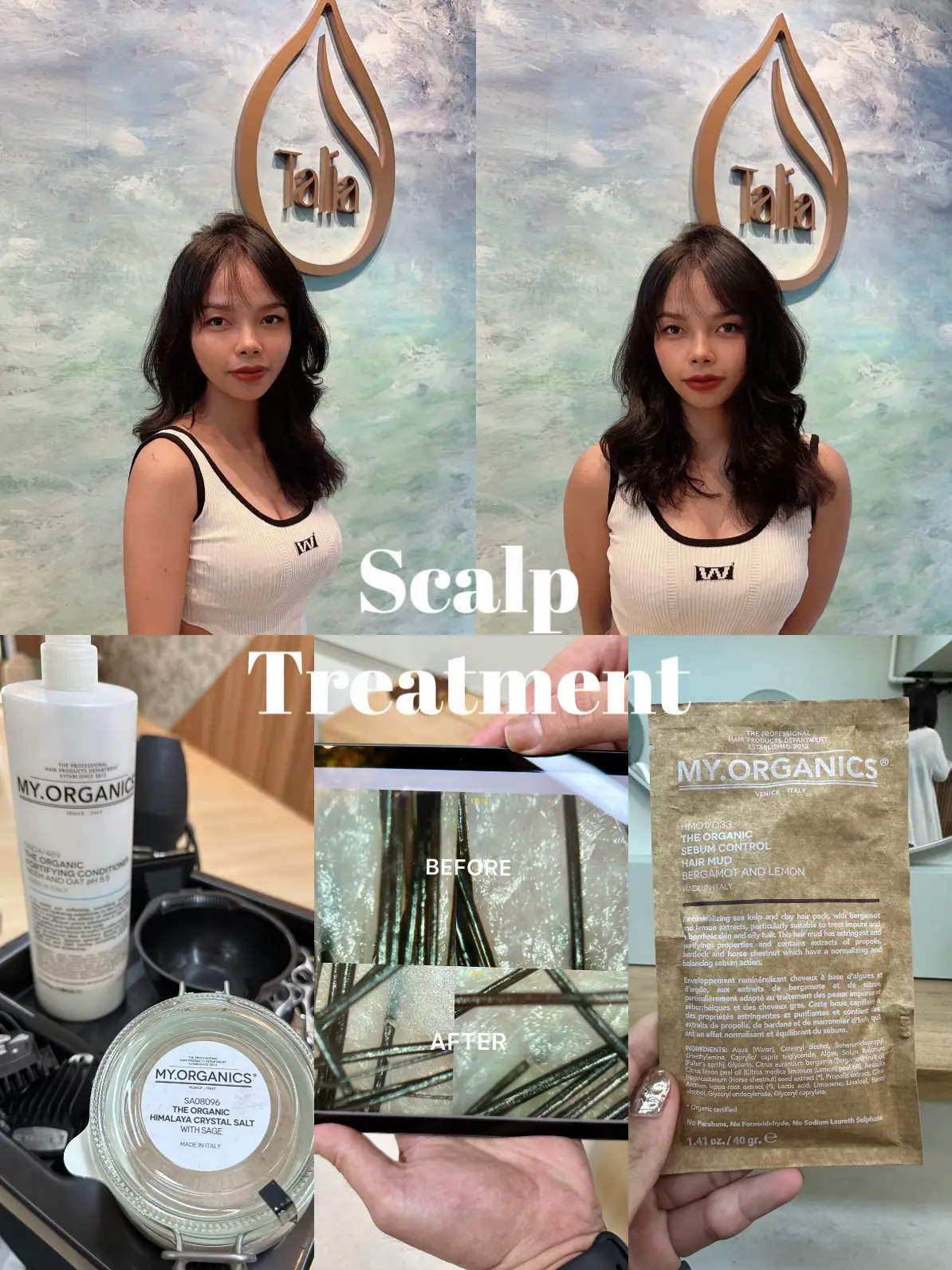 Scalp + treatment | Gallery posted by JS SJ | Lemon8