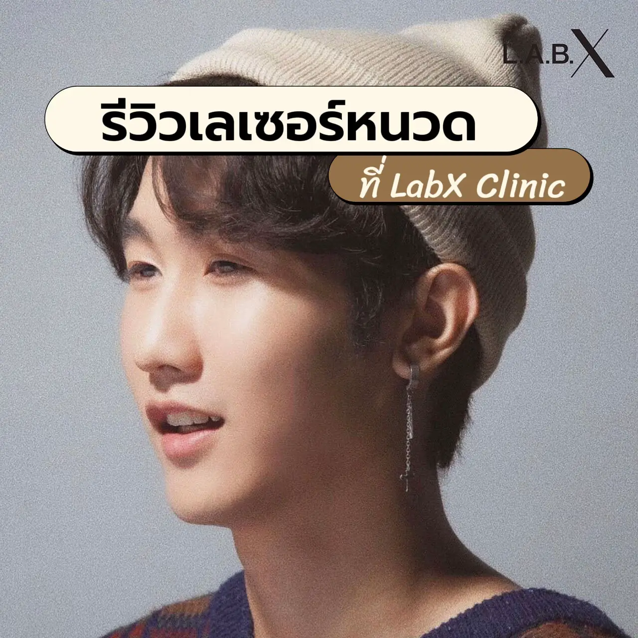 เลเซอร์หนวด หนวดเด้งออกมาสะใจมาก | แกลเลอรีที่โพสต์โดย Labx clinic | Lemon8