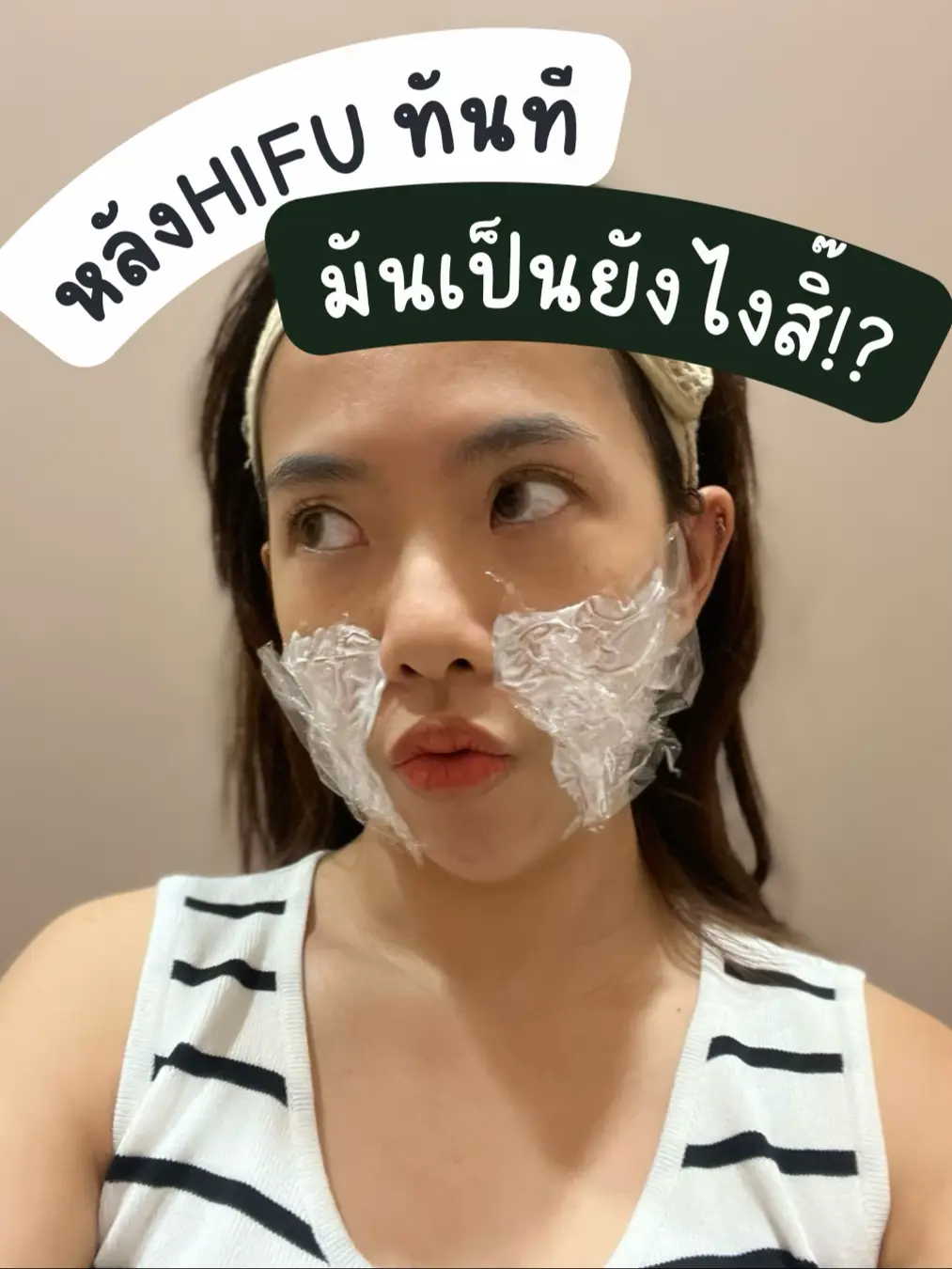 ความรู้สึกหลังทำ Hifu ทันที | วิดีโอที่เผยแพร่โดย Sa Thananchamon | Lemon8