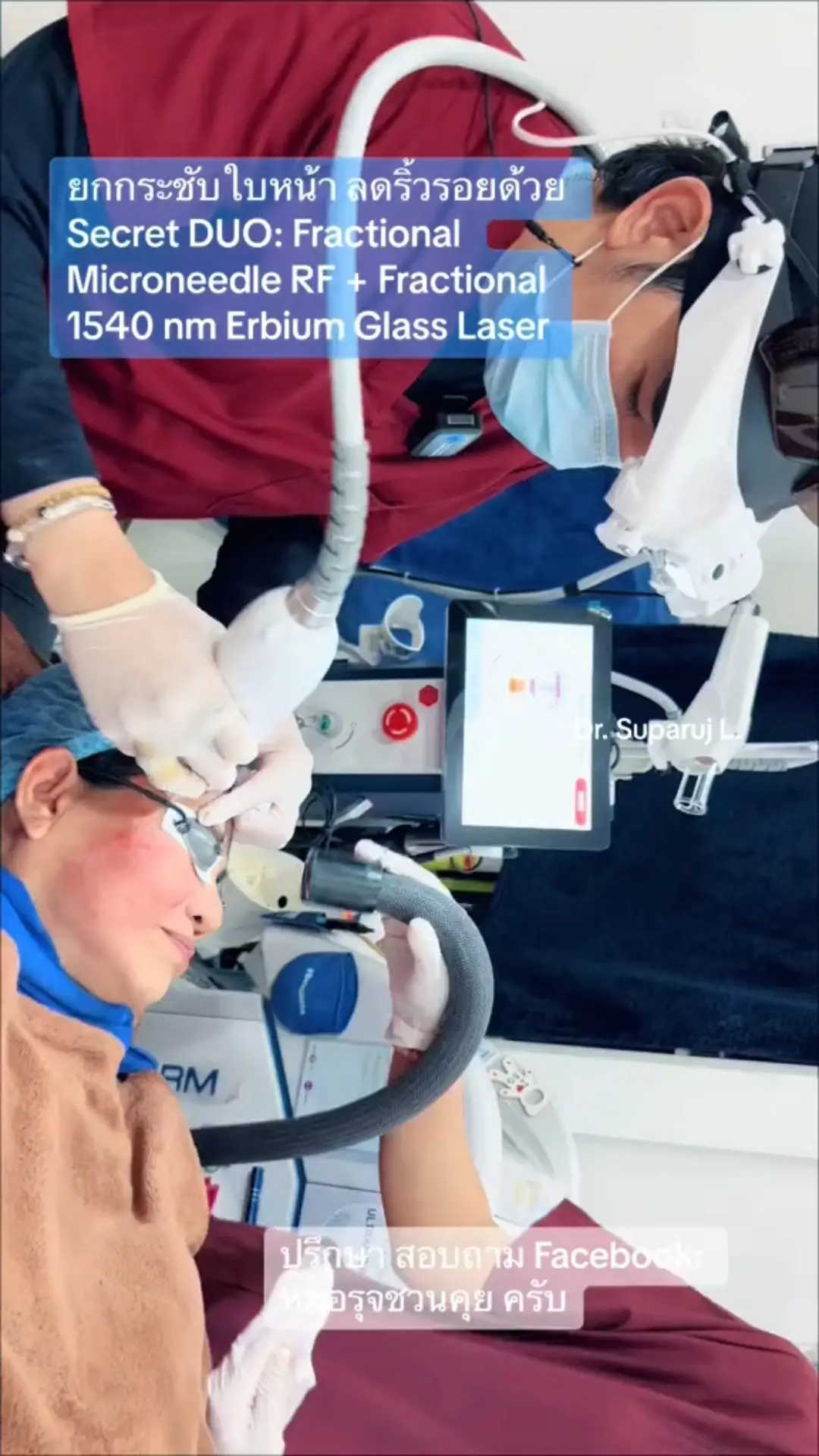 ยกกระชับใบหน้า ลดริ้วรอยด้วย Secret DUO | วิดีโอที่เผยแพร่โดย หมอรุจชวนคุยRuj | Lemon8
