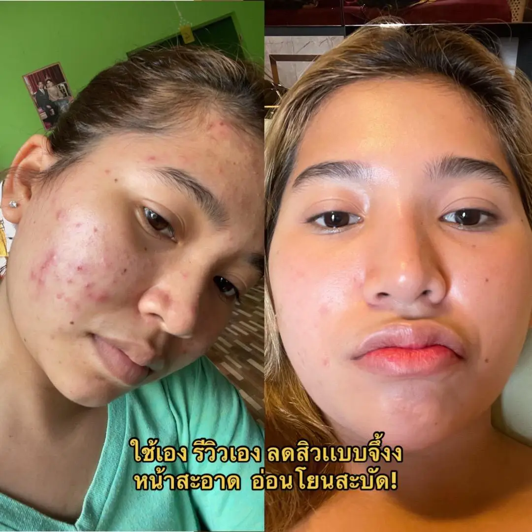 เจลล้างหน้าที่ใช้มาตลอด 2 ปี | แกลเลอรีที่โพสต์โดย fongfah.official | Lemon8