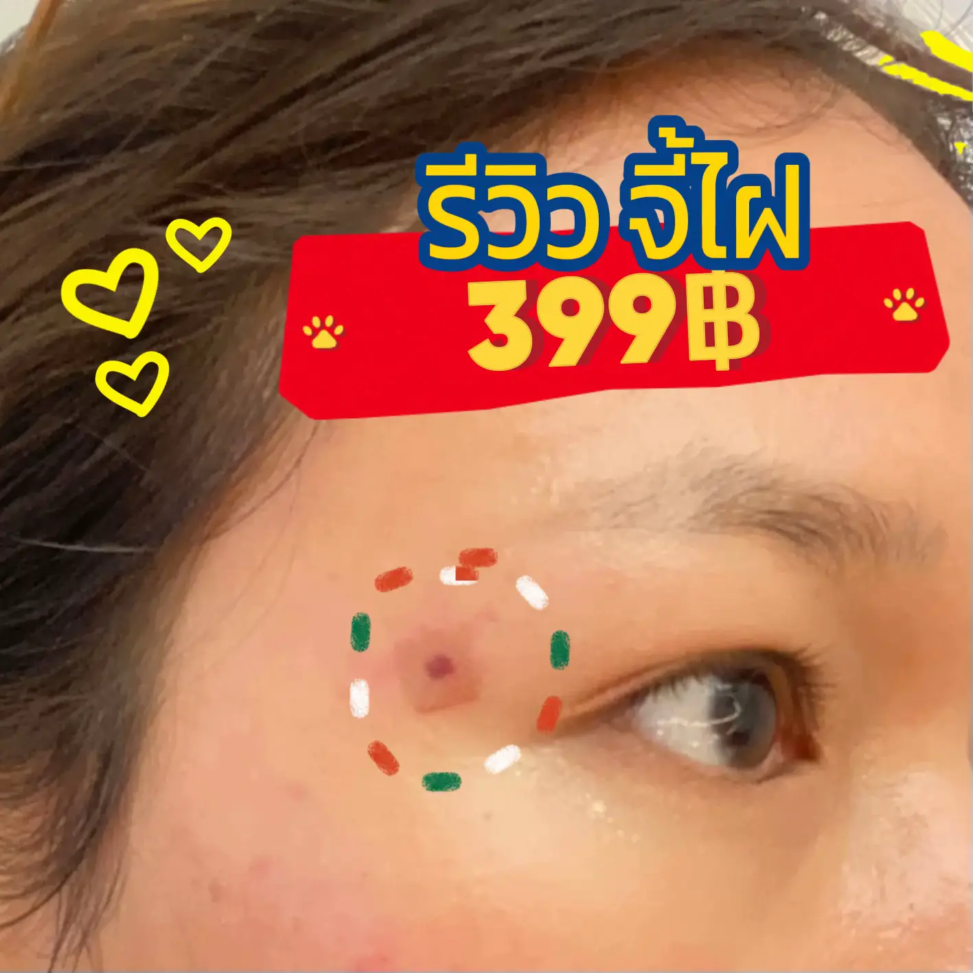 จี้ไฝเจ้าน้ำตา ใจกลางสยาม 399฿ + ยาทา 100฿ Net | แกลเลอรีที่โพสต์โดย Chalala 🦋 | Lemon8