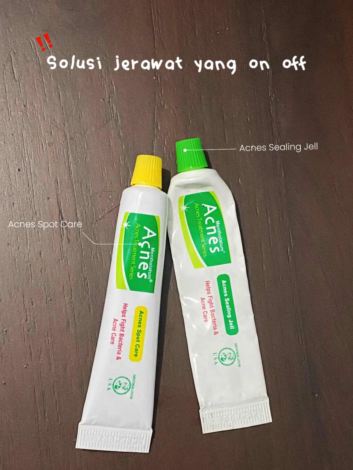 Solusi jerawat yang on off | Galeri diposting oleh Risma Ayu | Lemon8