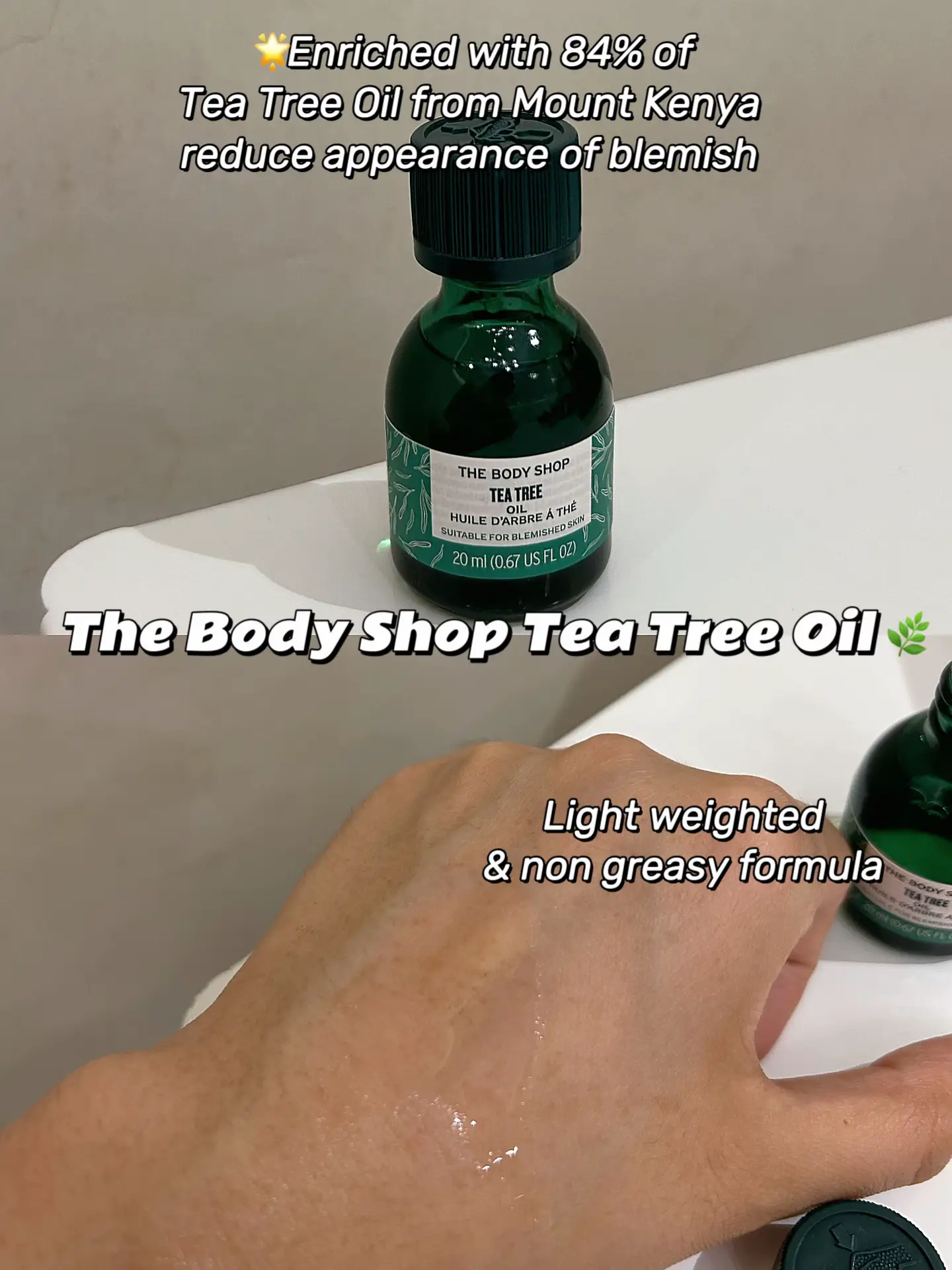 My Skin After 2 weeks of Tea Tree Remedy🌿 | Galeri disiarkan oleh ...