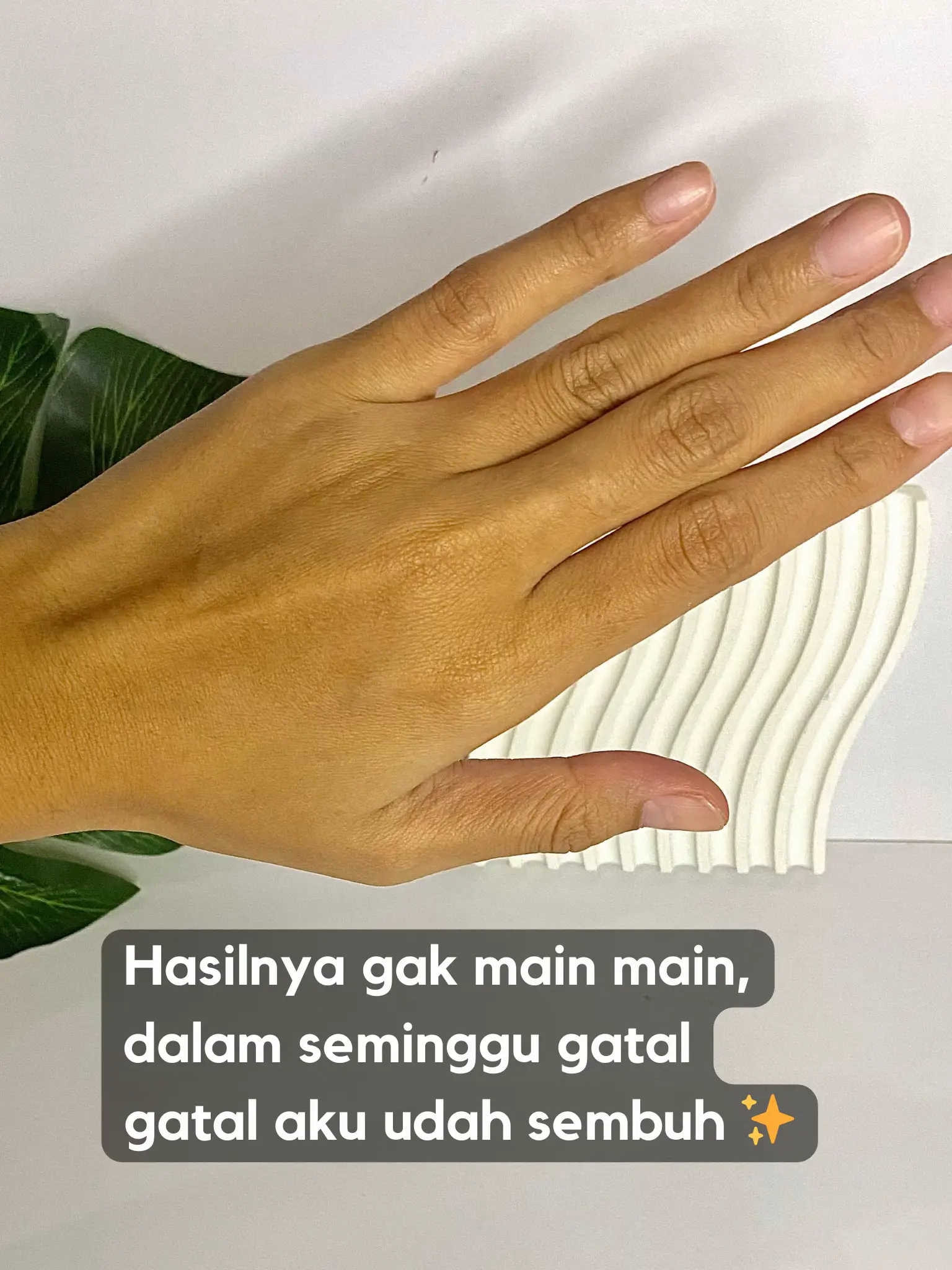 KULIT GATAL SEMBUH DALAM 1 MINGGU ⁉️ | Galeri diposting oleh Fini | Lemon8