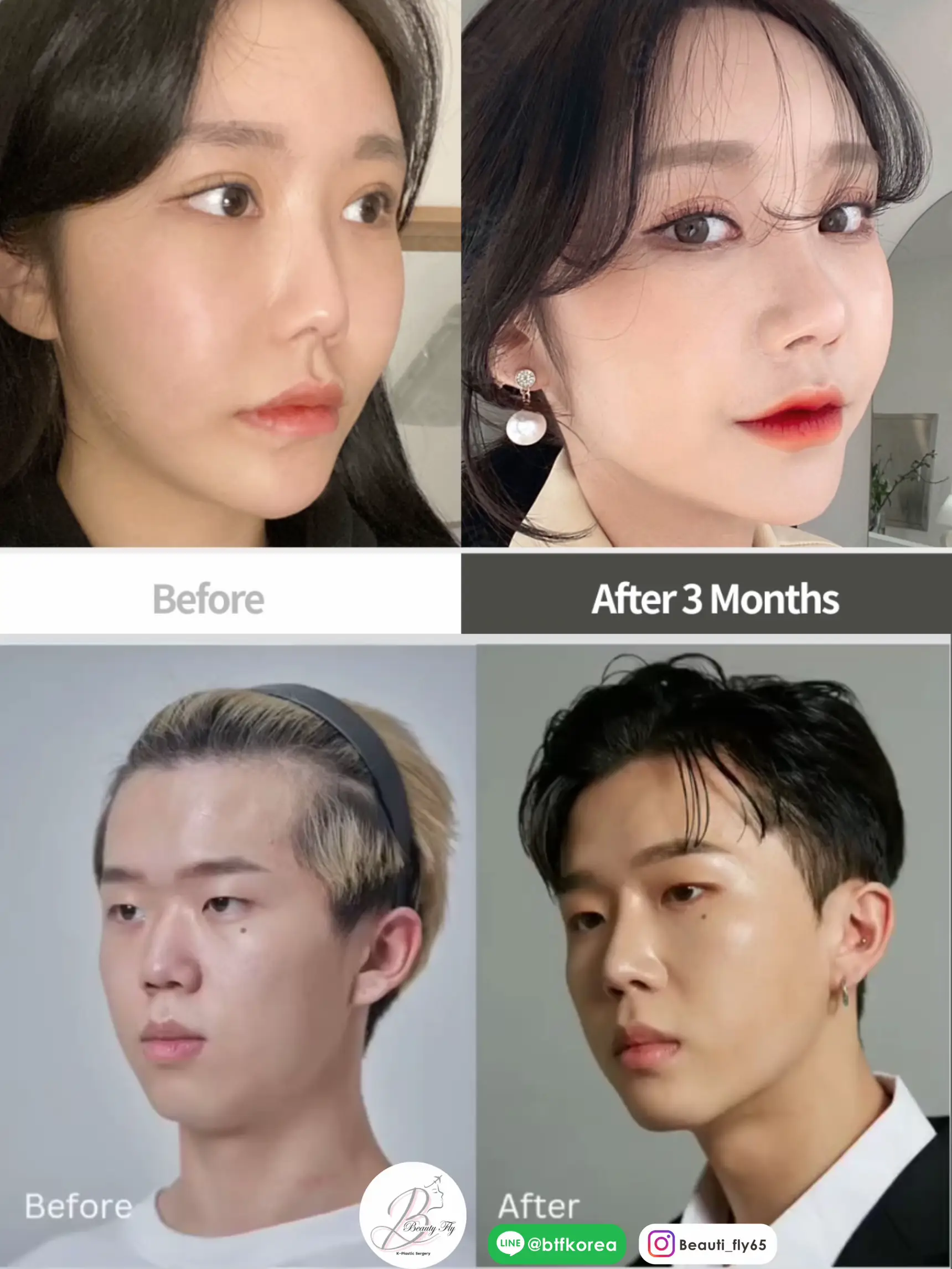 สวย หล่อ ในสไตล์ที่ยังเป็นตัวเอง | แกลเลอรีที่โพสต์โดย Noom BTF | Lemon8