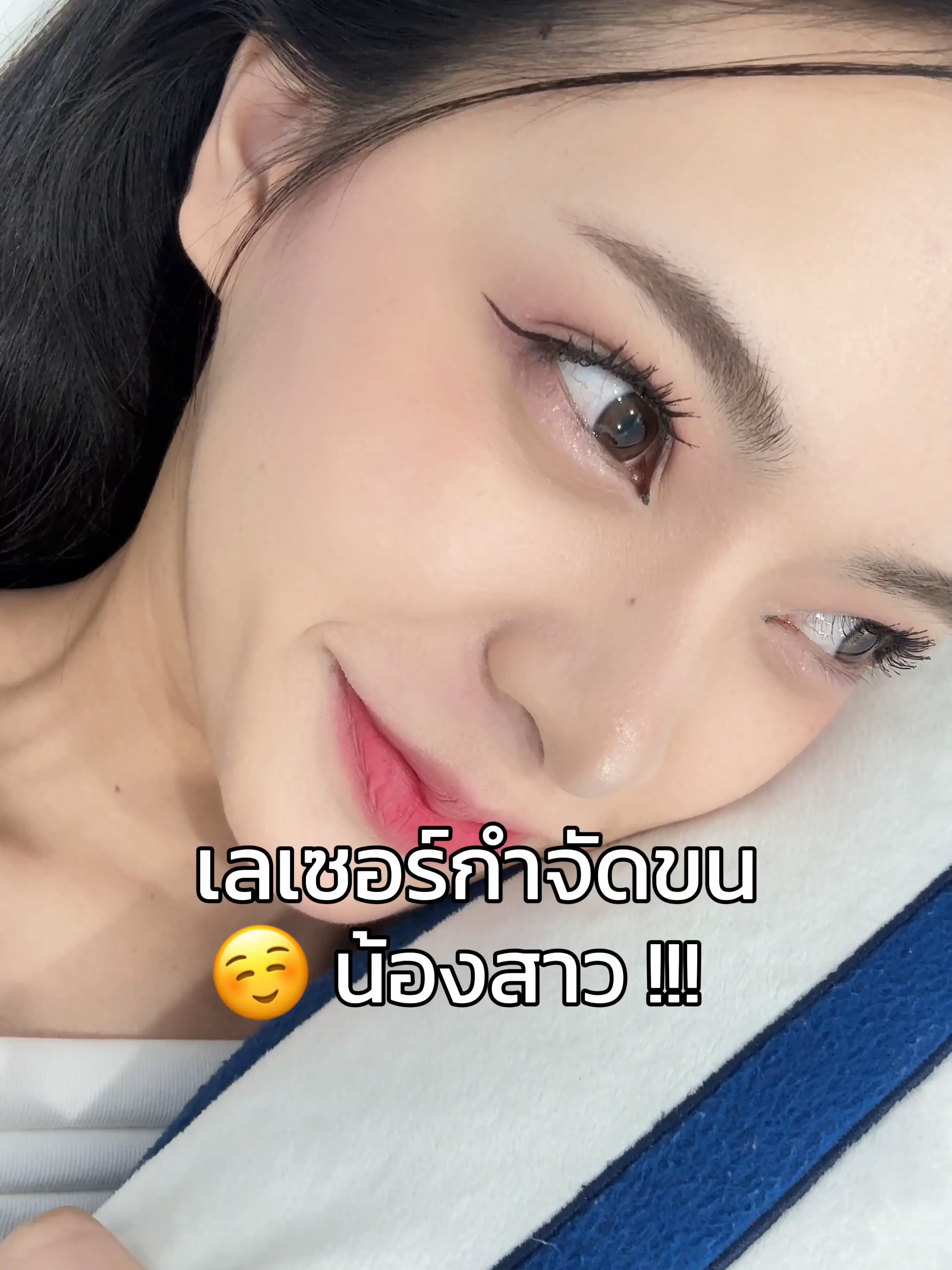 เลเซอร์กำจัดขนน้องสาว >
