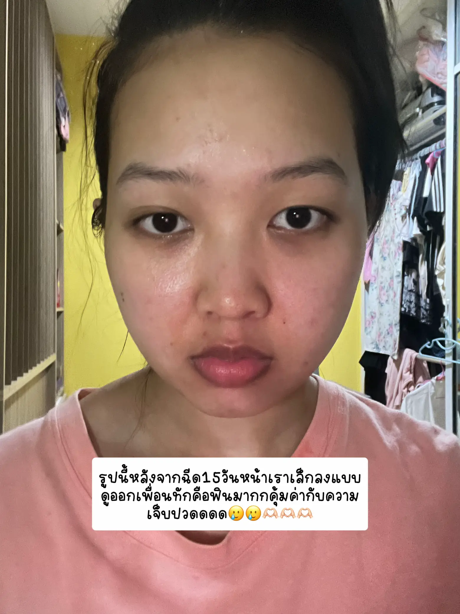 รีวิวแฟต33ccแบบไม่อวย‎ྀི🎀🪞🩰🦢 | แกลเลอรีที่โพสต์โดย P Peaw Peaw | Lemon8