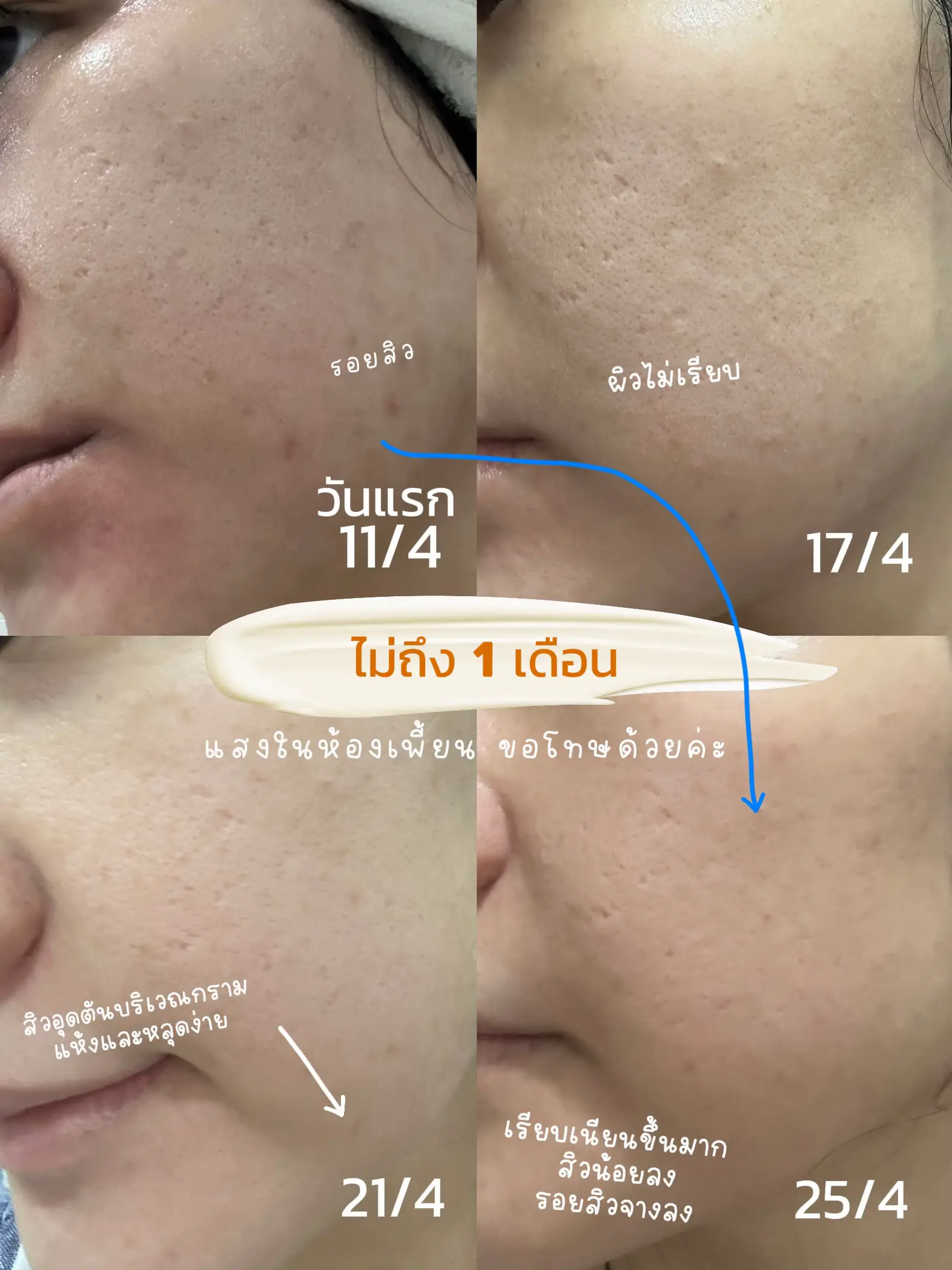 เรตินอลที่คนผิวแพ้ง่ายใช้ได้😍 | แกลเลอรีที่โพสต์โดย realmin | Lemon8