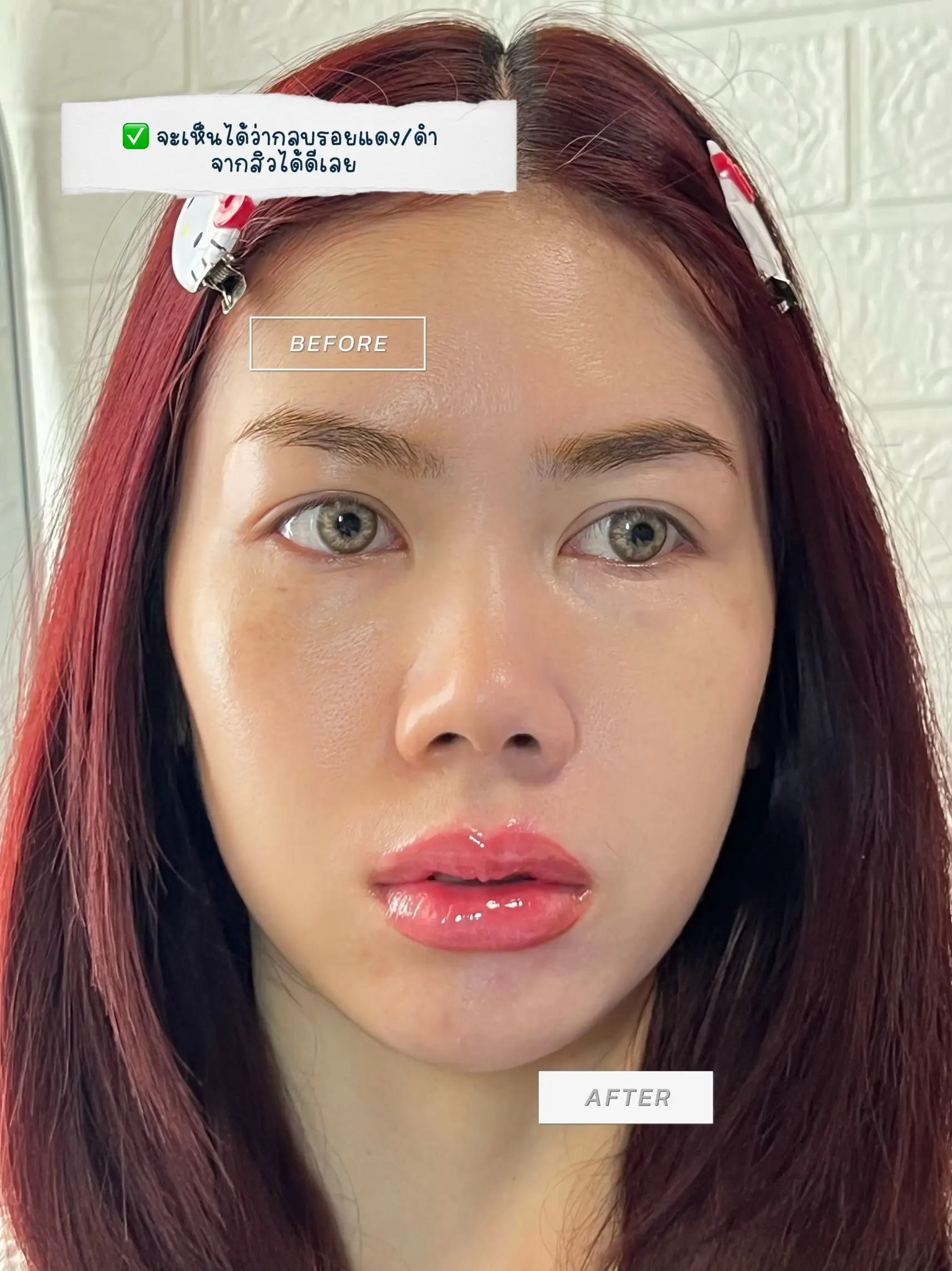 #แชร์ทริค(ไม่)ลับ | หน้าไบร์ท ผิวใสออร่า ท้าแดดเมืองไทย💖☀️ | แกลเลอรีที่โพสต์โดย cherngam | Lemon8