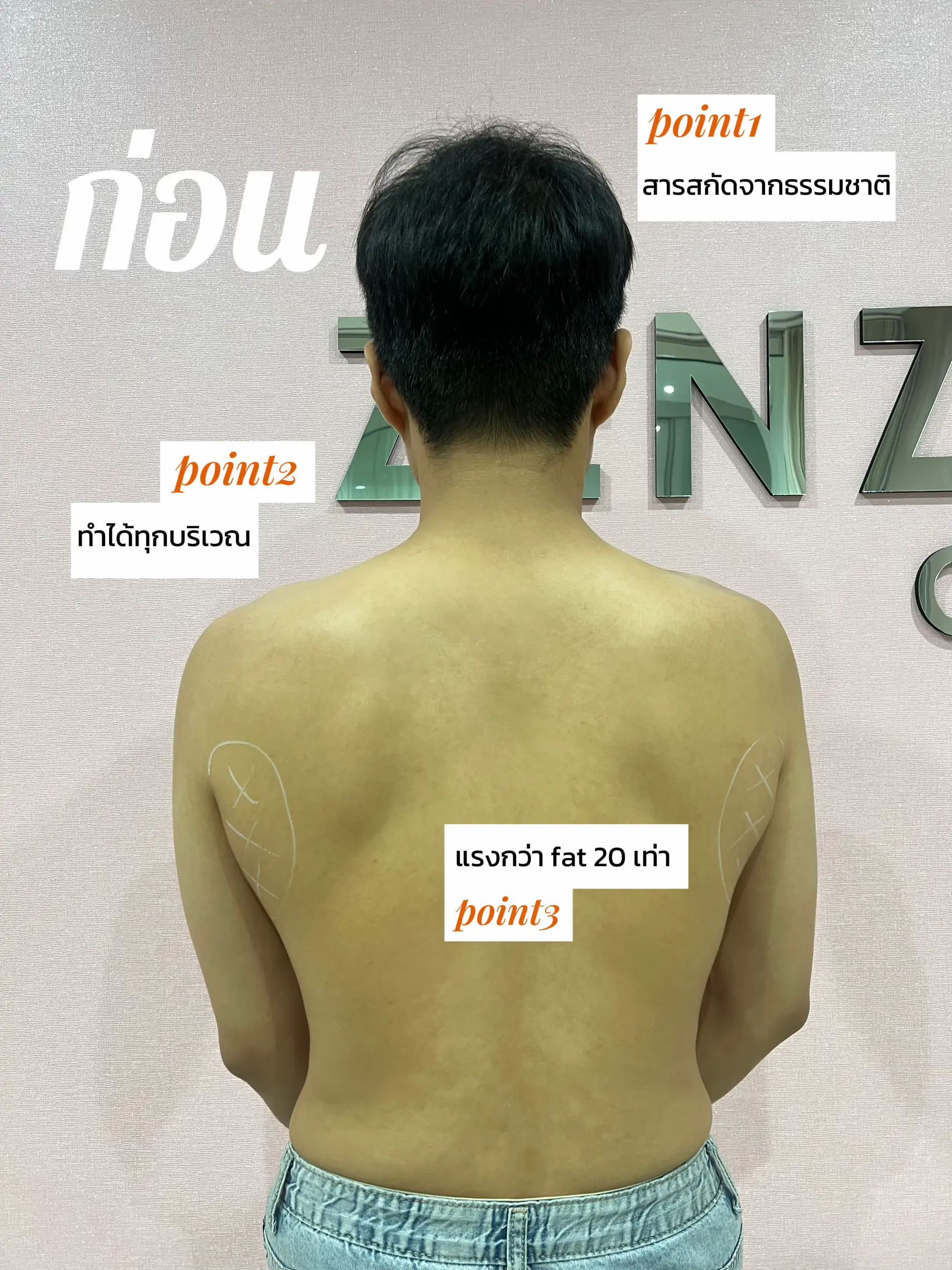 โปรเเกรม Lipo Crystal at Zenzen Clinic | แกลเลอรีที่โพสต์โดย ZENZEN ...