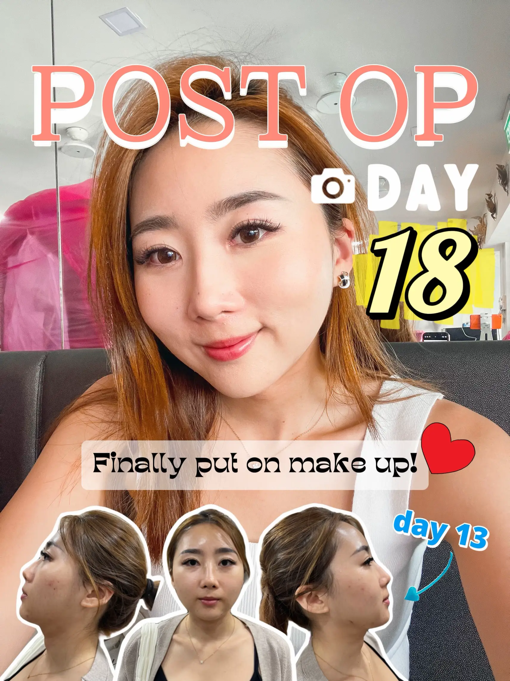 🇰🇷POST OP DAY 18: Finally put on make up! 💄 | Gallery posted by Zara Lim 💜 | Lemon8