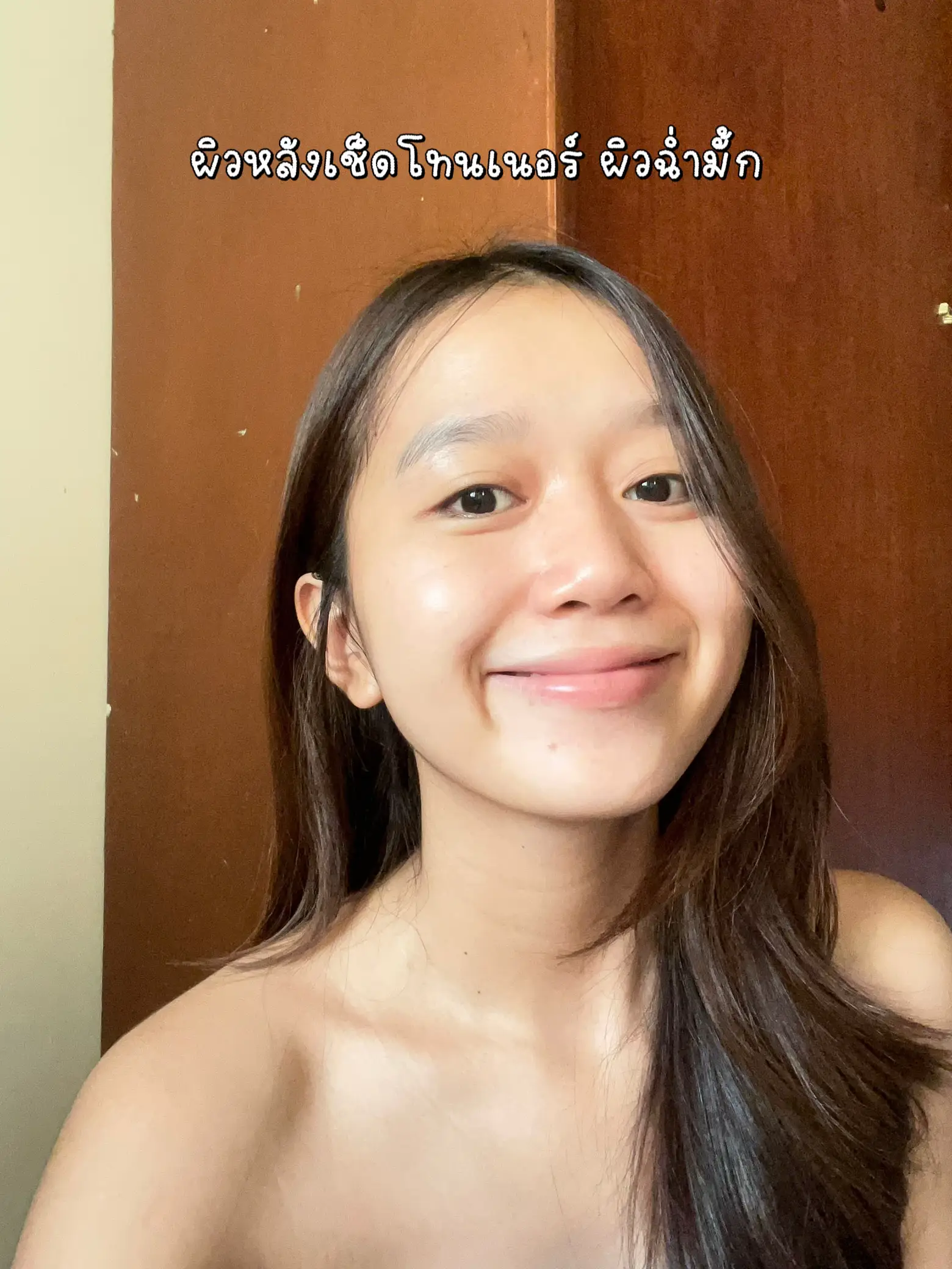 โทนเนอร์ฉบับคนเป็นสิว ต้องลอง 🫶🏻👀 | แกลเลอรีที่โพสต์โดย nisc.h | Lemon8