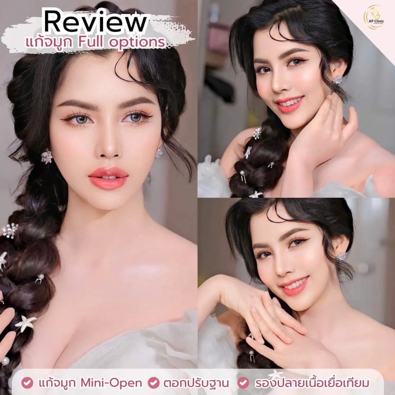 แก้จมูก | แกลเลอรีที่โพสต์โดย Waraphon Rueang | Lemon8