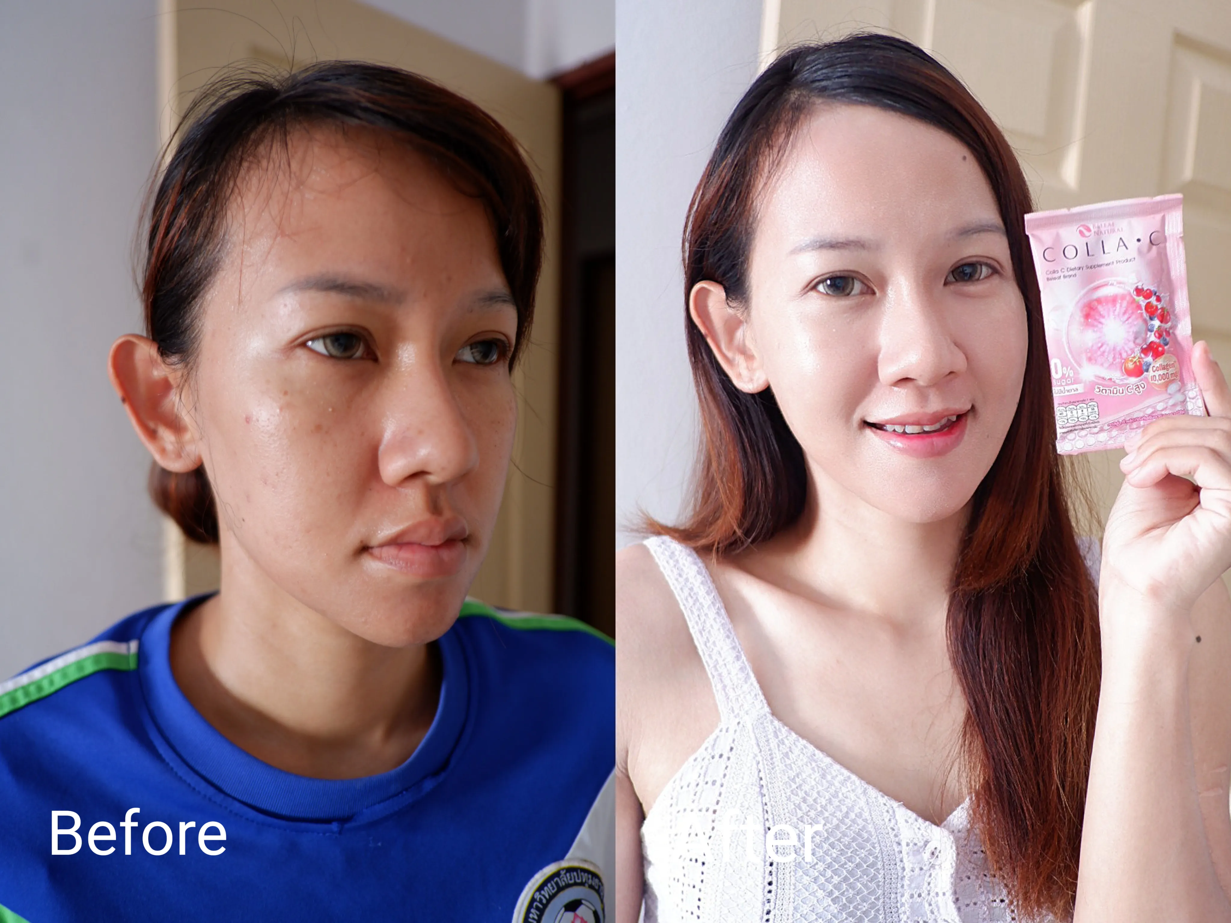 คอลลาเจน Colla-c กู้ผิวโทรมในกล่องเดียว | แกลเลอรีที่โพสต์โดย Numsom Araya | Lemon8