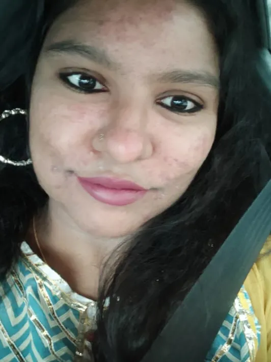 Good morning lemon8's :) | Gallery posted by Siva Shangari V | Lemon8