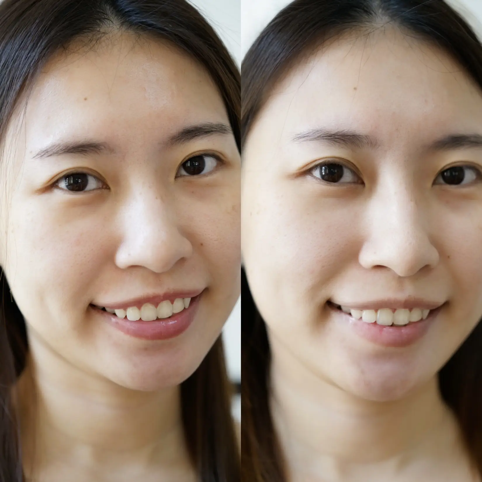 สบู่ล้างหน้า ช่วยกู้ผิวหน้า | แกลเลอรีที่โพสต์โดย Mindy | Lemon8