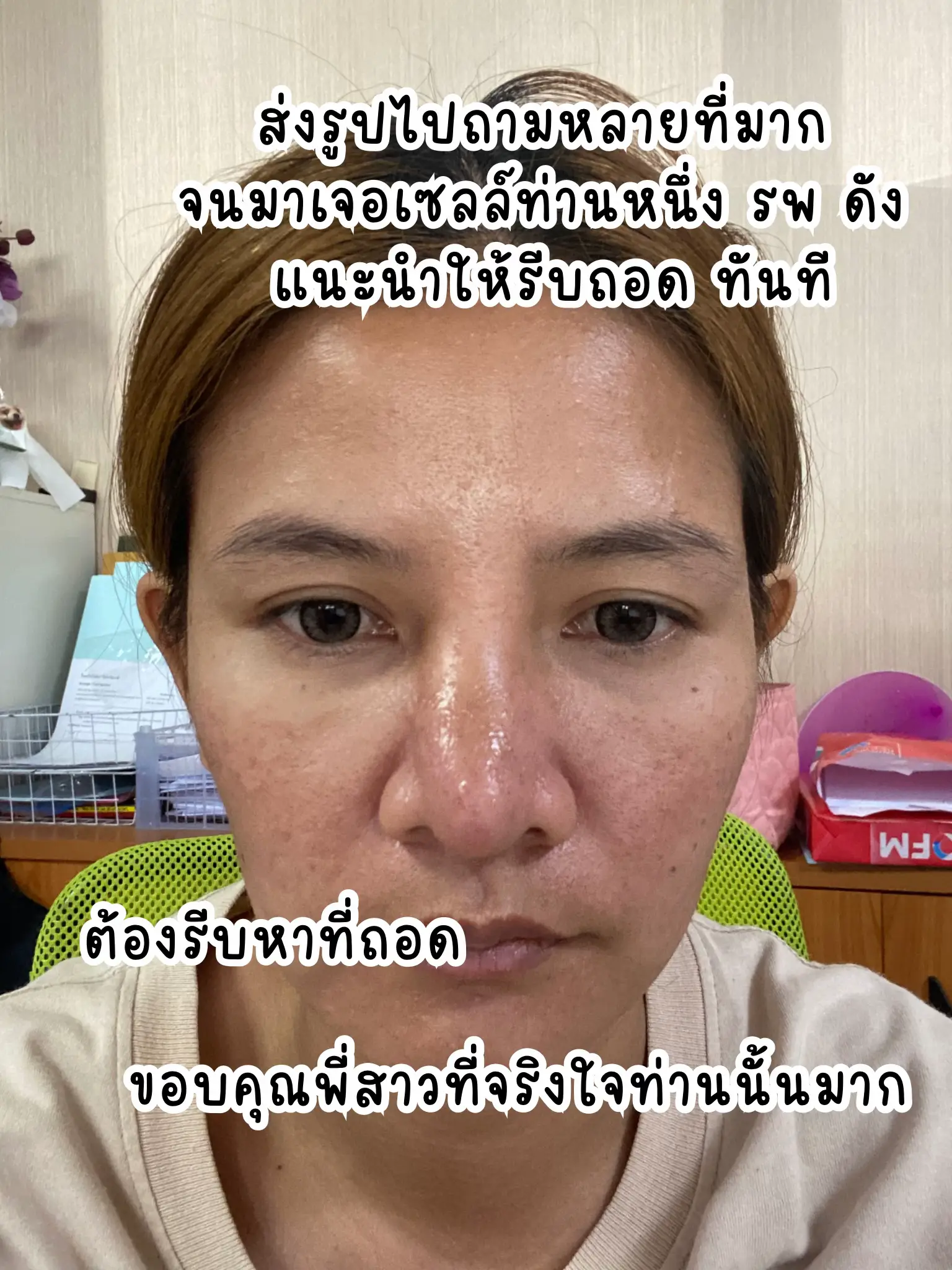 ลดบวม Proctase-P คือ ยา แก้ อะไร - การค้นหาใน Lemon8