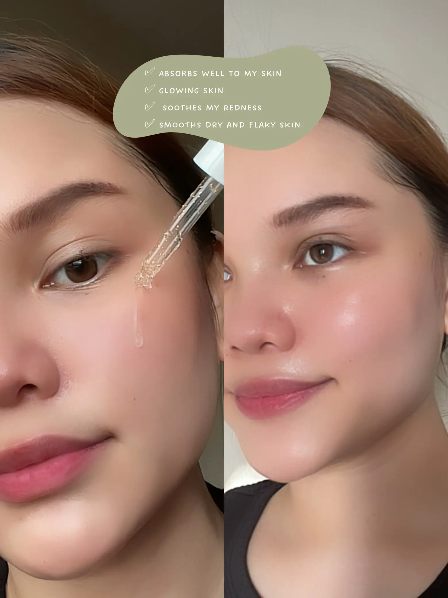 GLOW UP JOURNEY DULL TO BRIGHT SKIN | แกลเลอรีที่โพสต์โดย fatinnrha ...