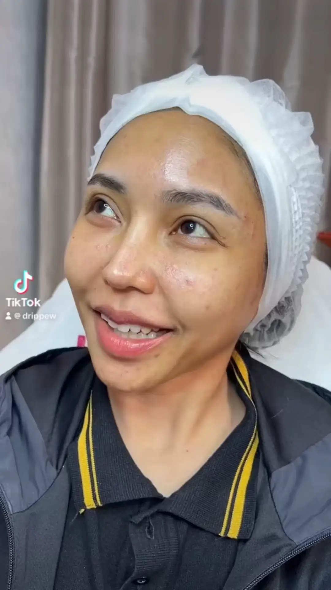 การทำเลเซอร์ ดีกับหลุมสิวจริงหรือ? | วิดีโอที่เผยแพร่โดย Dr.Nat Clinic ...