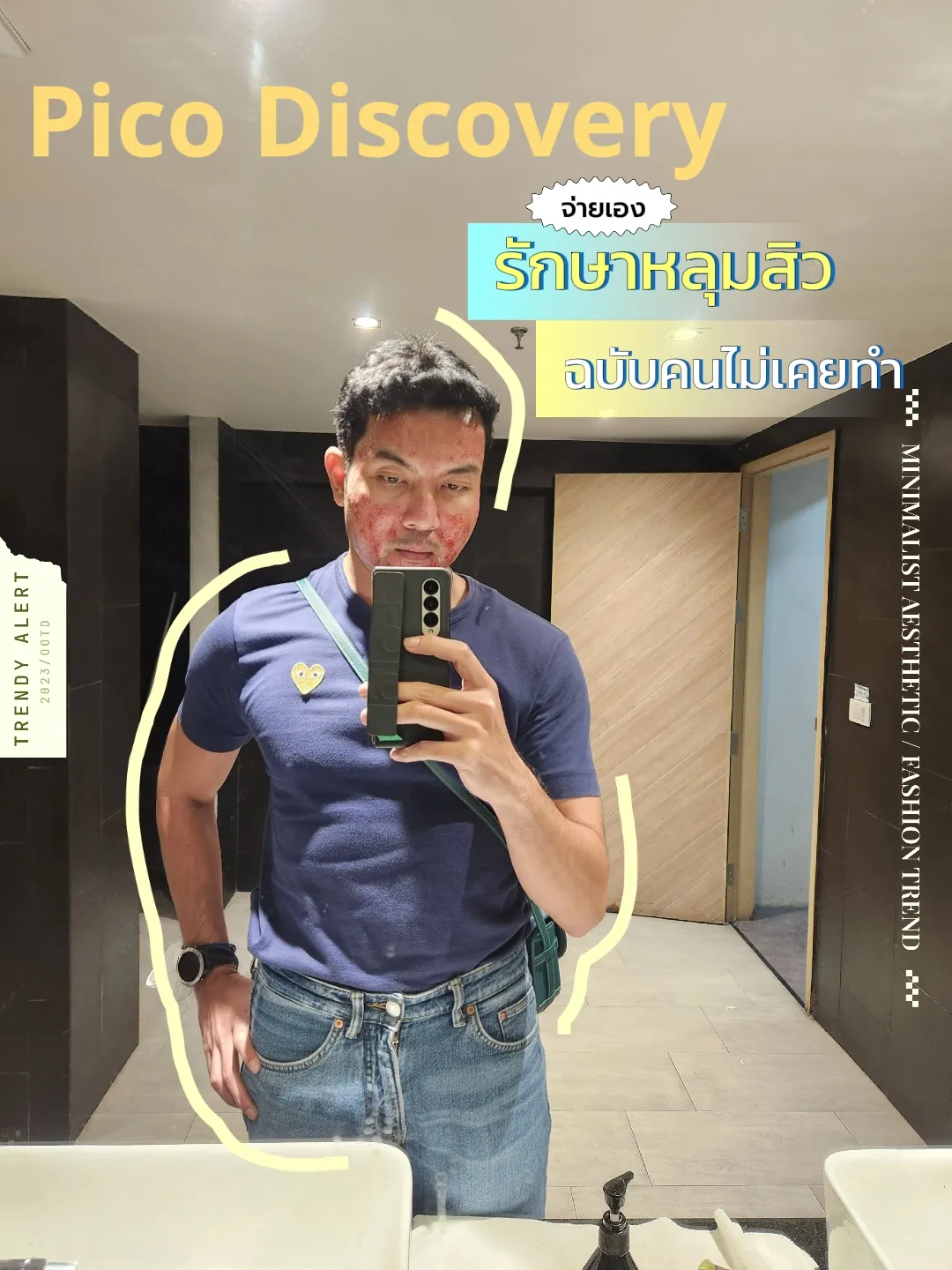 Pico Discovery #ผิวเนียนเหมือนพระจันทร์ | แกลเลอรีที่โพสต์โดย Park ไปเรื่อย | Lemon8