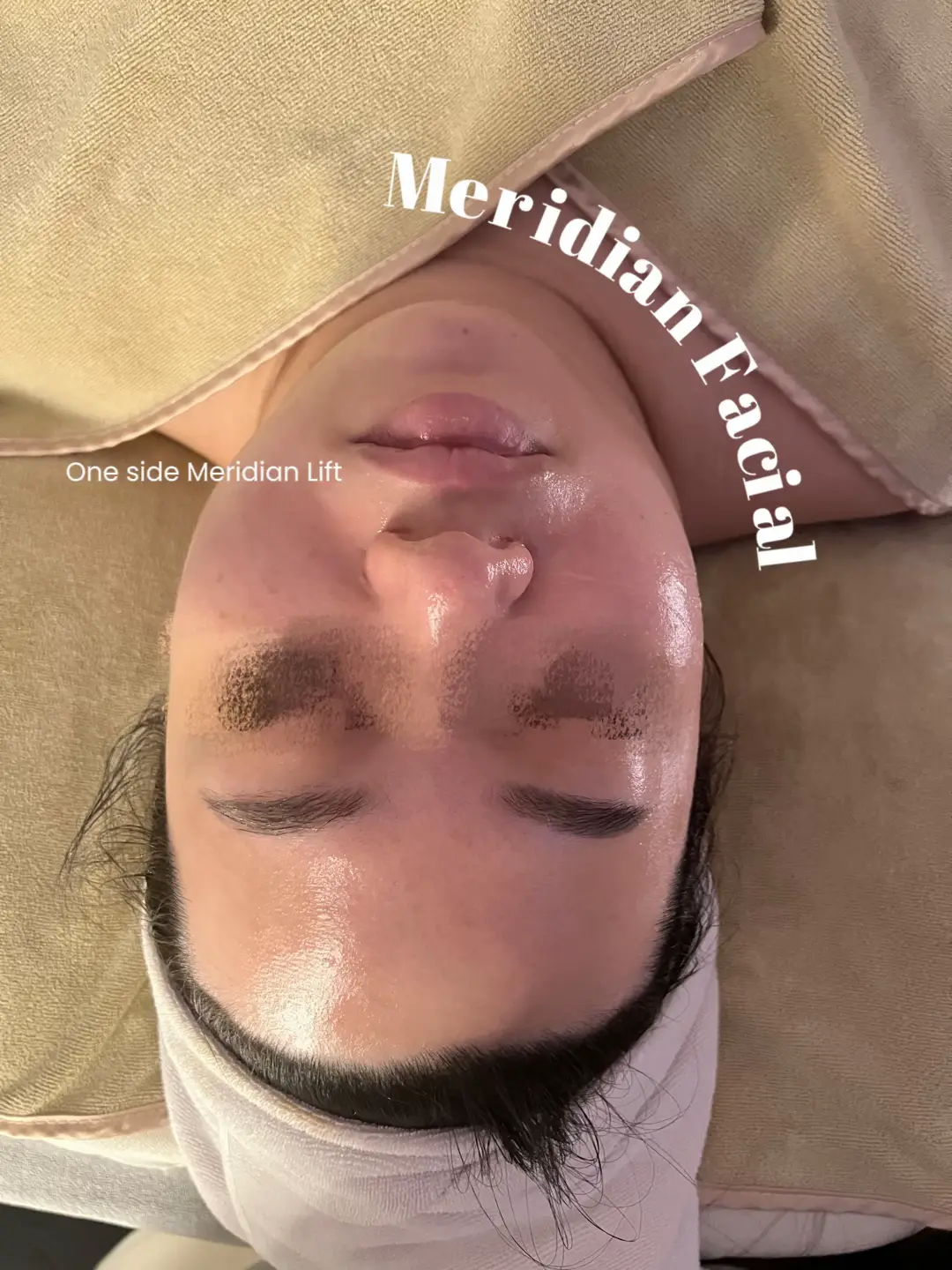 SG Meridian Facial | Gallery posted by Beautecrew-Lyn | Lemon8