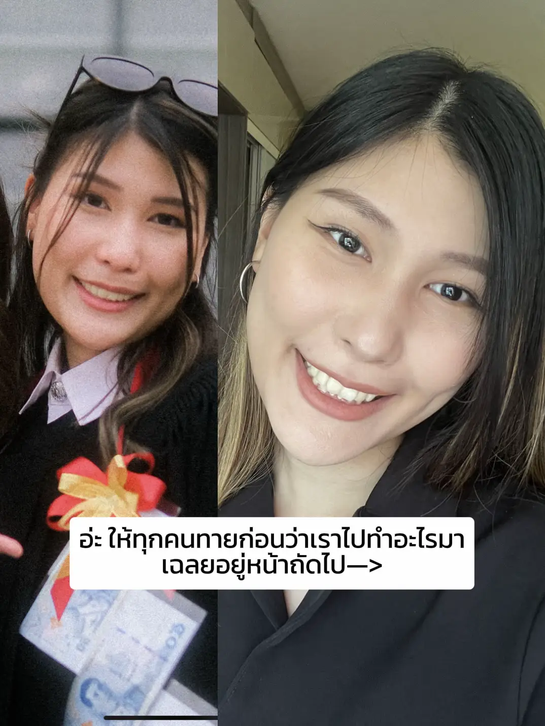 รีวิวที่จริงใจ: วิธีสวยขึ้นใน 1 เดือน by Talisa Clinic | แกลเลอรีที่ ...