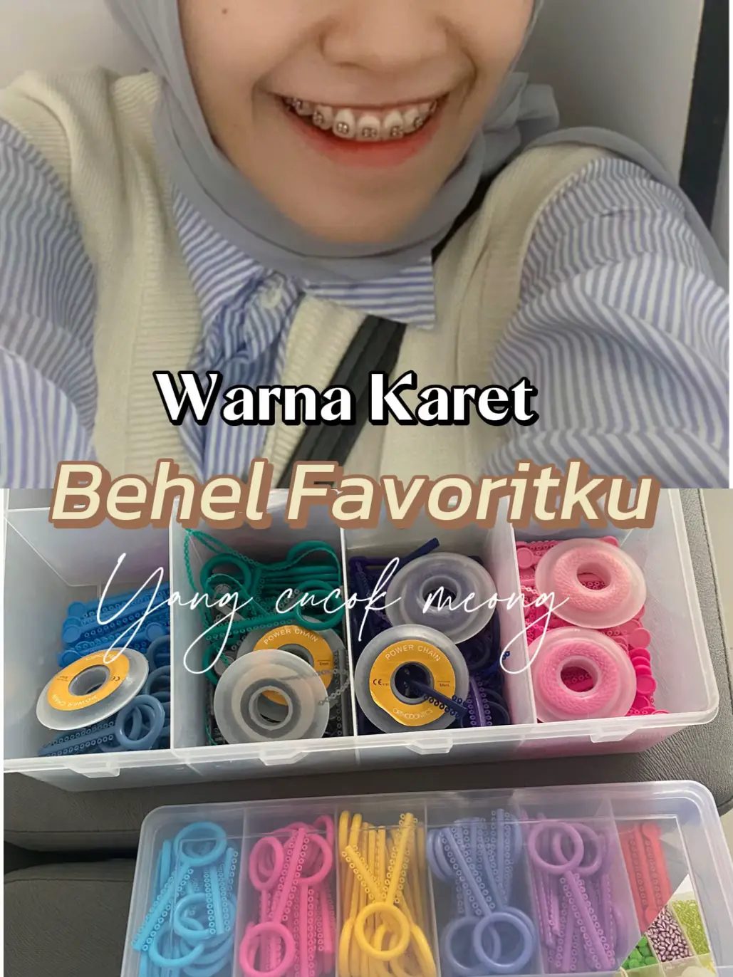 Warna Karet Behel Favorit | Galeri diposting oleh Purple🌸 🌻 | Lemon8