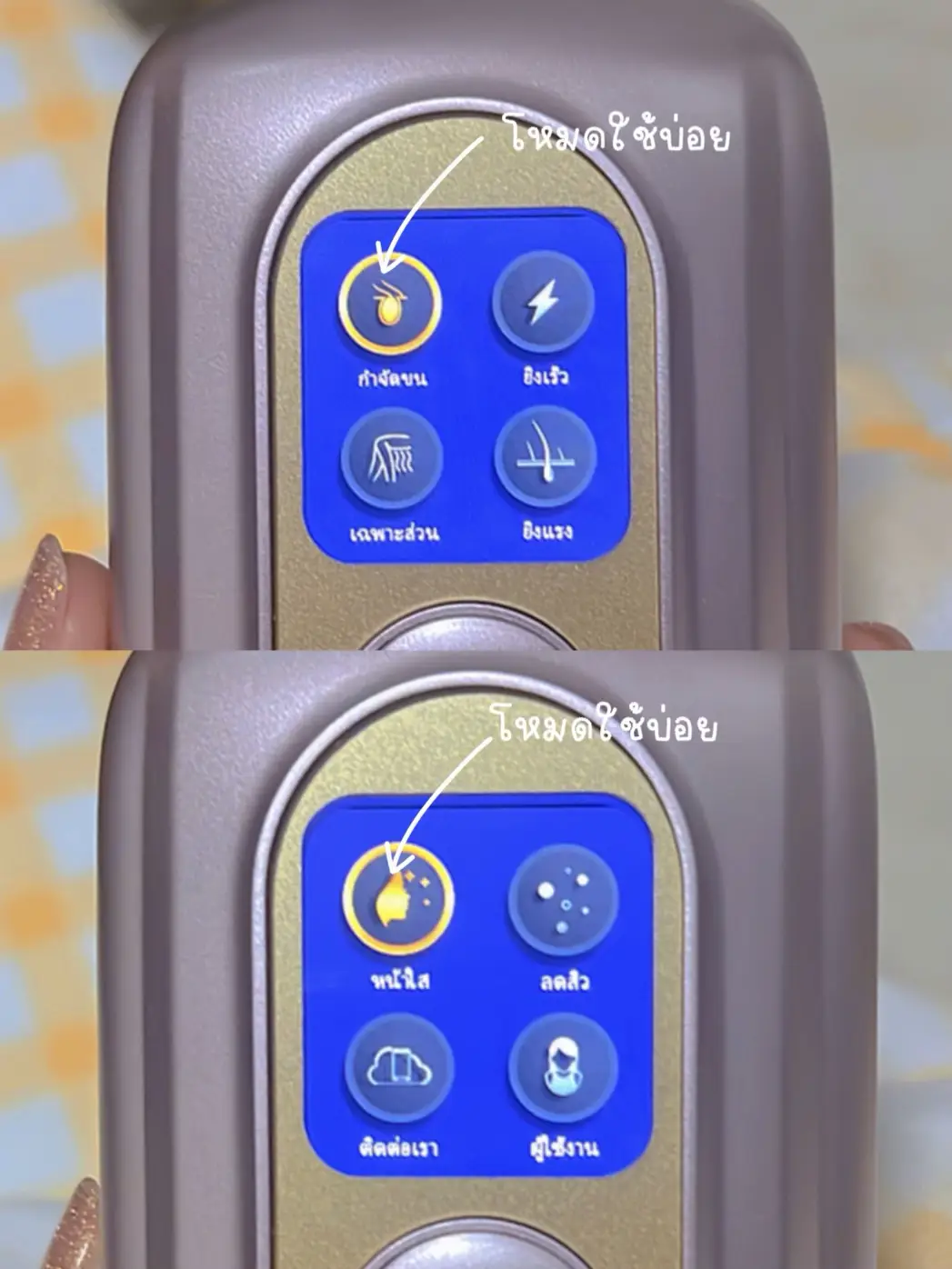 ทำเลเซอร์เองที่บ้านรอดมั้ย ? | แกลเลอรีที่โพสต์โดย Bowwy Pattamawa | Lemon8