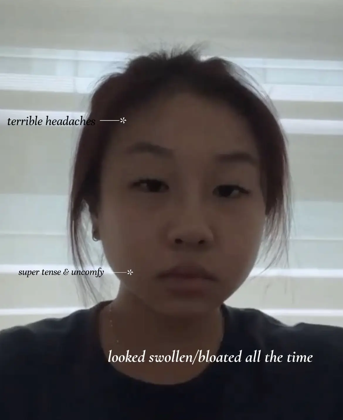 slimmer face? no more headaches? SAY LESS | Gallery posted by ...