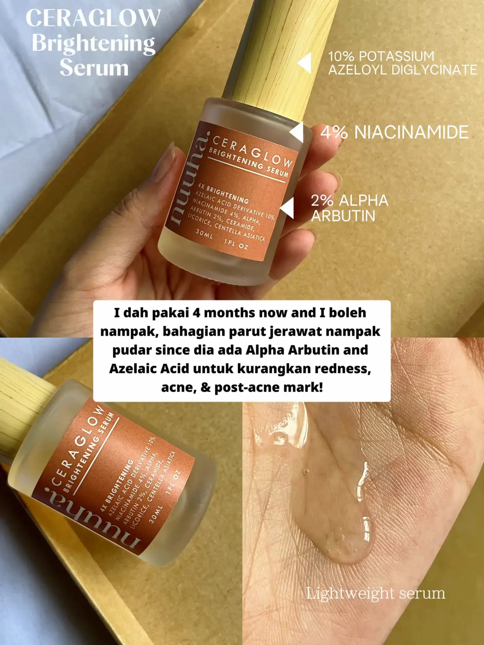 Kurangkan Bekas Parut Jerawat Dengan Products Ni! | Galeri disiarkan ...