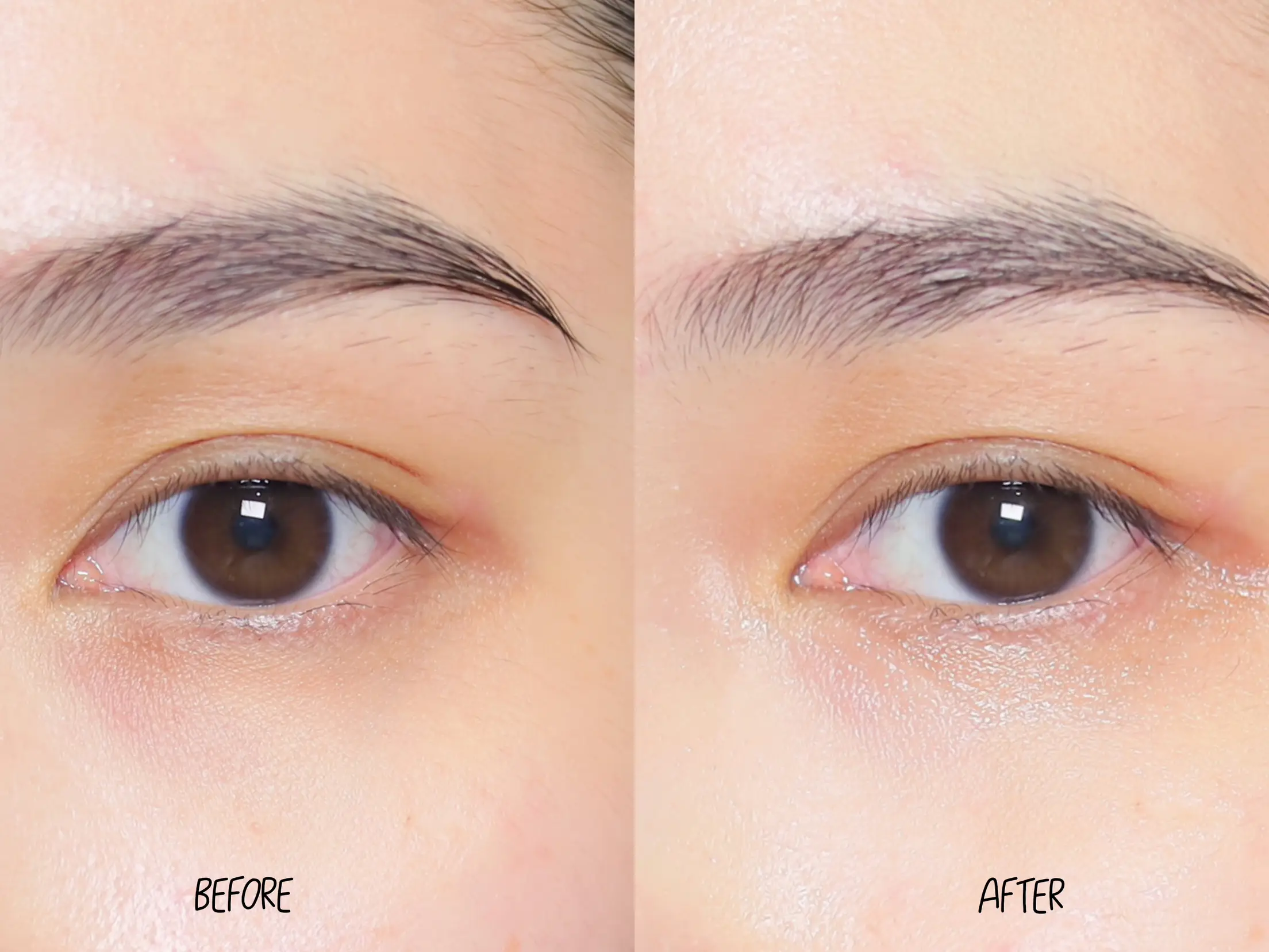 One minute of eye massage is like eight hours of rest with FOREO IRIS ...