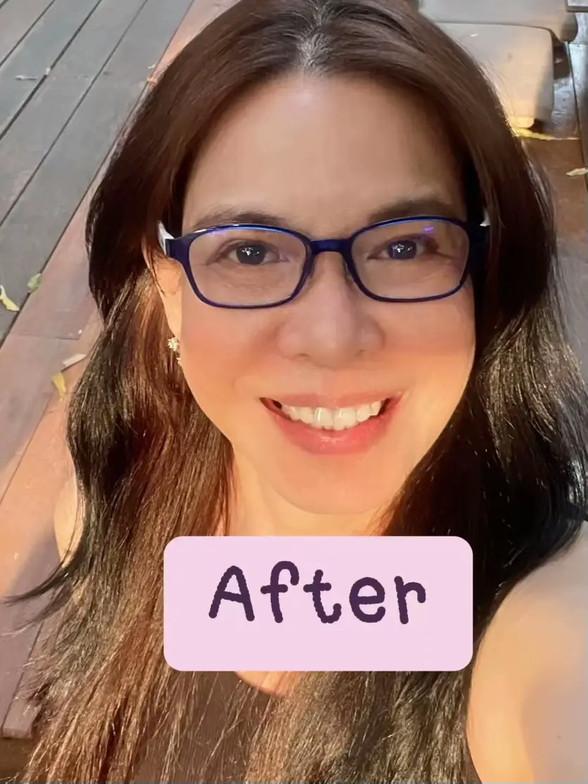 รีวิวฟอกสีฟันครั้งแรก ในวัย 54!! ราคาดี 2 ใบเทามีทอน!! | แกลเลอรีที่โพสต์โดย สายขิม 50++ | Lemon8