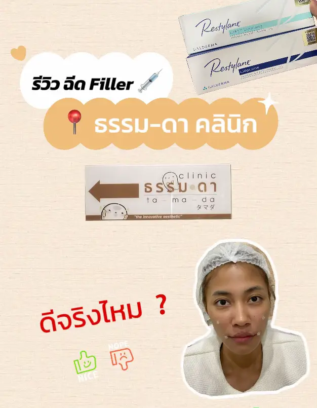 รีวิวฉีดฟิลเลอร์ใต้ตาเเละปาก ฉบับคนฉีดครั้งแรก | แกลเลอรีที่โพสต์โดย Aor Sureeporn | Lemon8