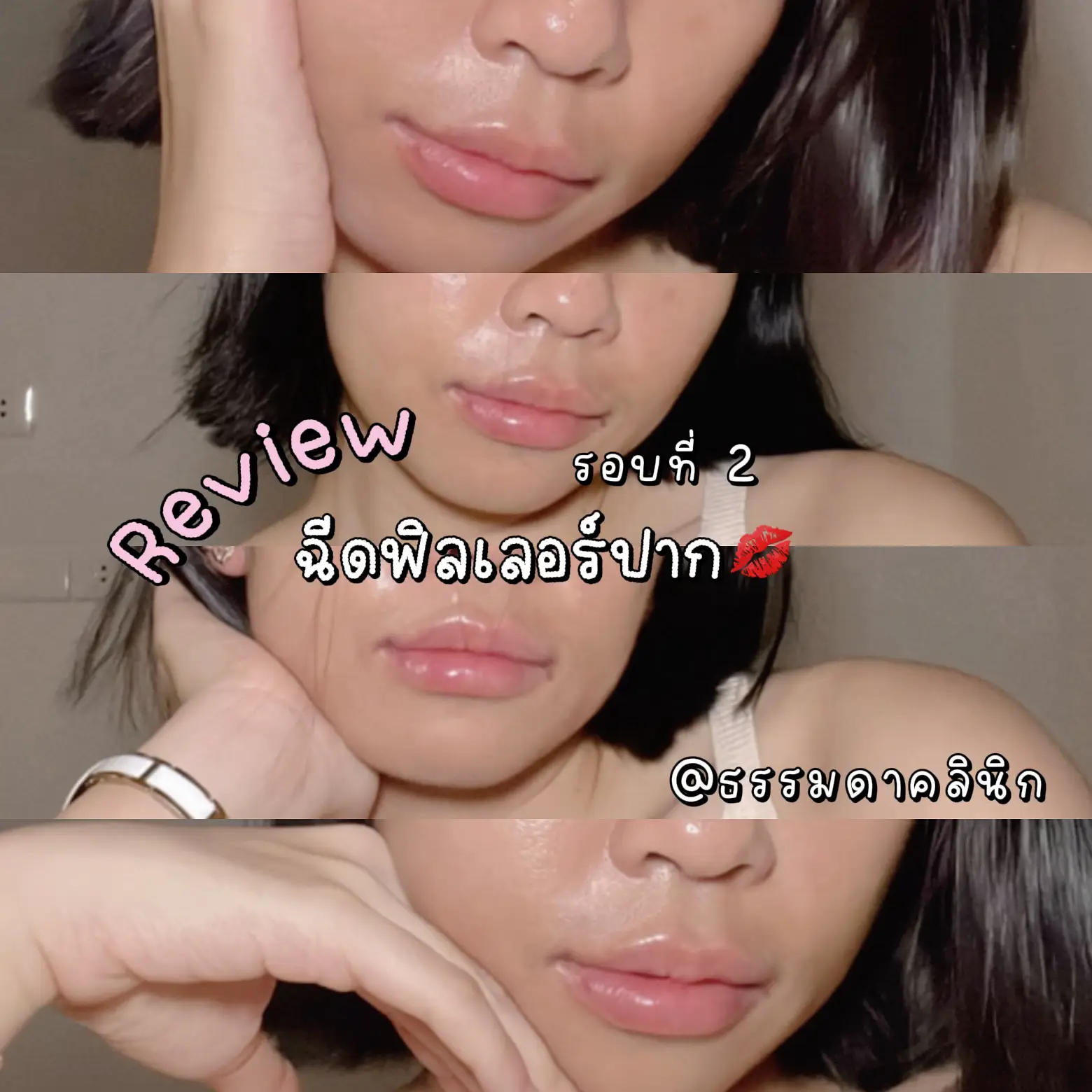 แชร์ประสบการณ์ฝังสีปากจ้า หัวเราะได้นะตามสบาย5555555 🥰 | แกลเลอรีที่โพสต์โดย หมีมาแชร์ | Lemon8