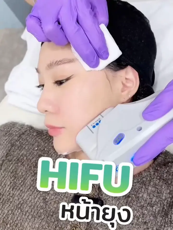 💗 ตัวตึงเรื่องยกหน้าด้วย HIFU 💗 | วิดีโอที่เผยแพร่โดย MIA รีวิว | Lemon8