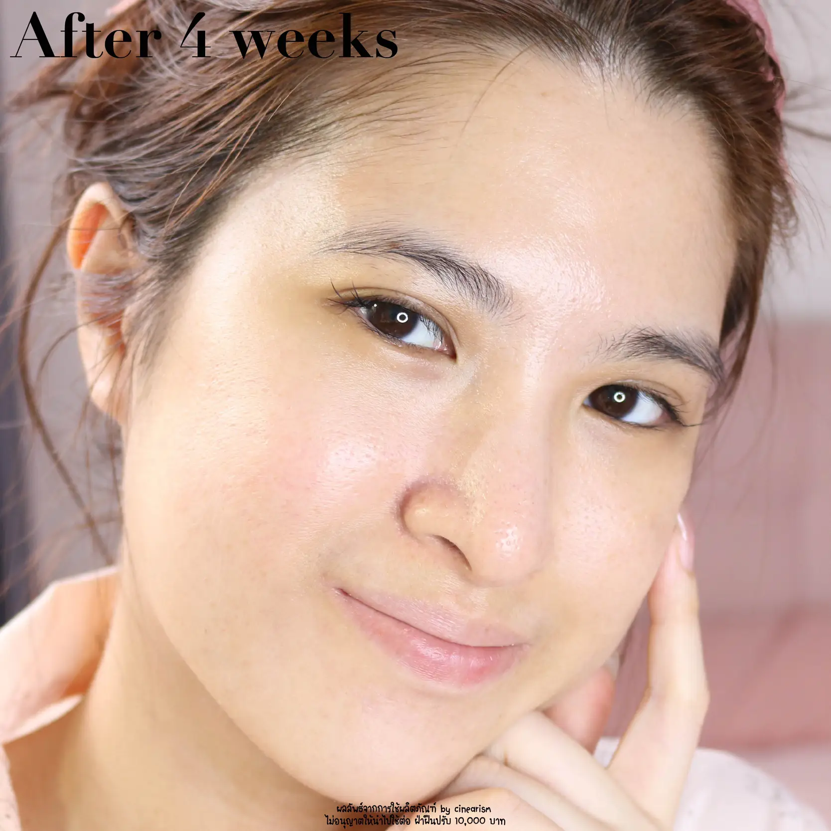 ไอเทมหยุดผิว!! ทรงประสิทธิภาพที่สุด ให้ผิวเด็กที่แท้จริง ️ | แกลเลอรีที่โพสต์โดย cinearism💀 | Lemon8