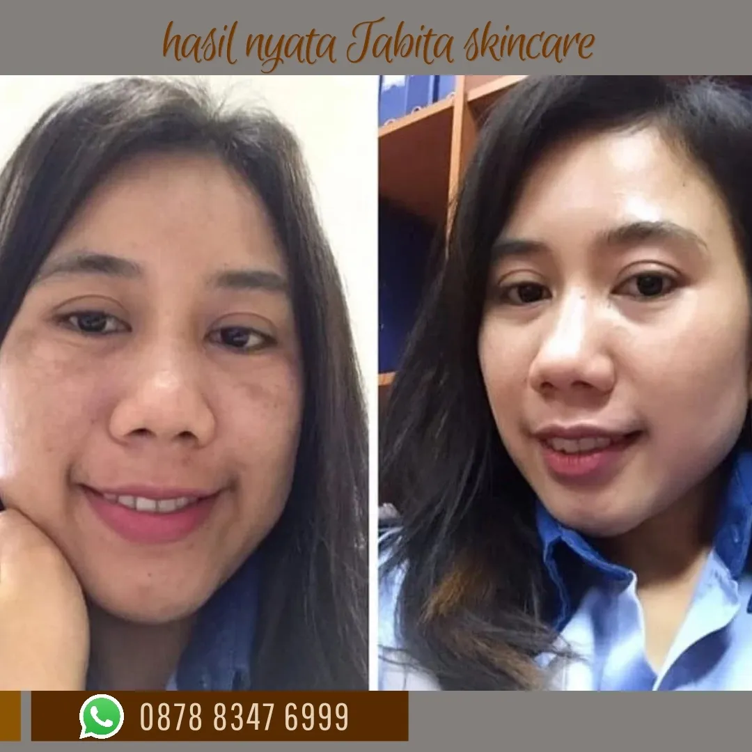 Tabita Skincare Hasilnya Nyata! | Galeri disiarkan oleh Tabita | Lemon8