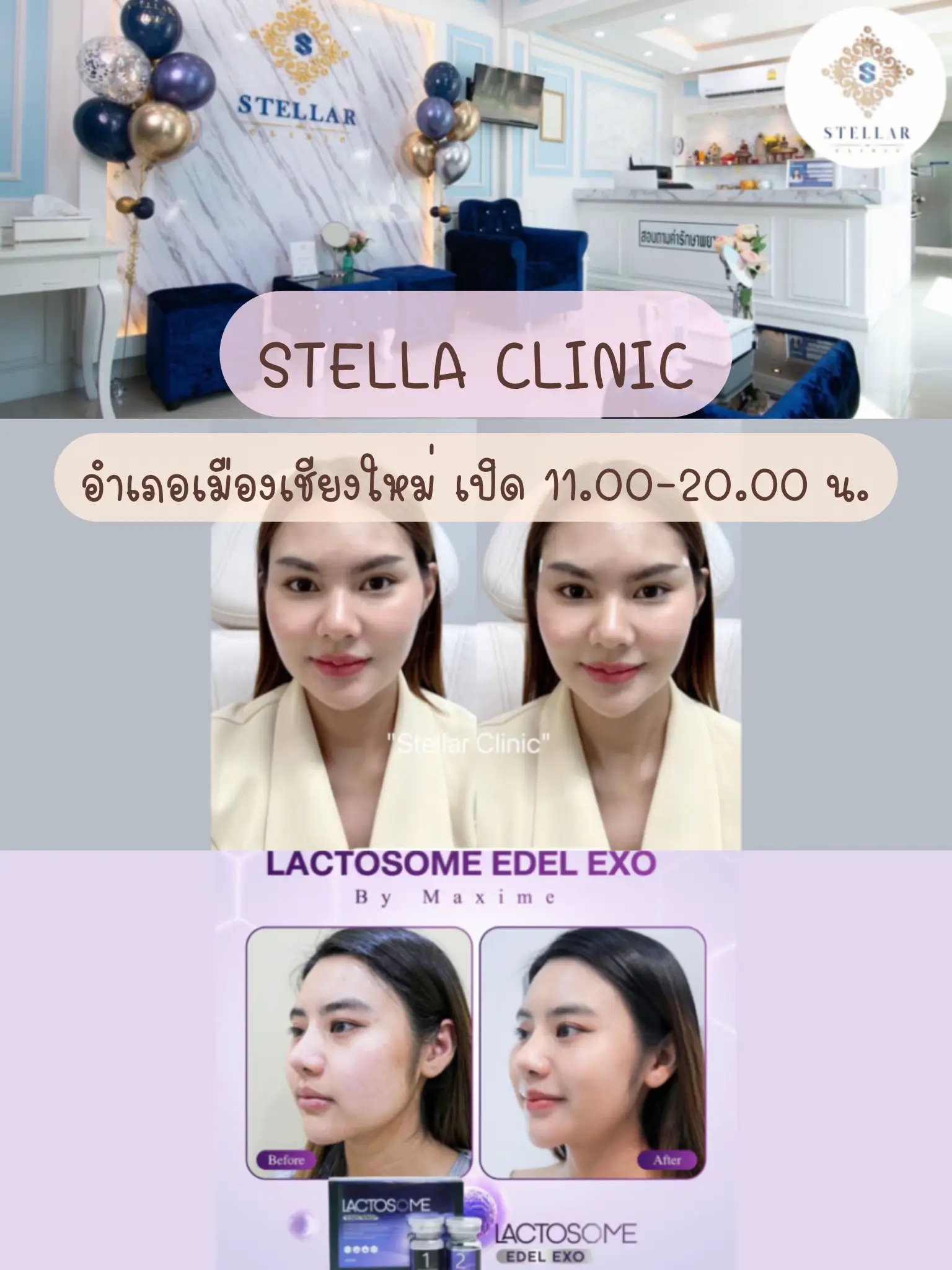 💁🏻‍♀️ป้ายยาคลินิกทำสวยรับสงกรานต์ในตัวเมืองเชียงใหม่💄 | แกลเลอรีที่ ...