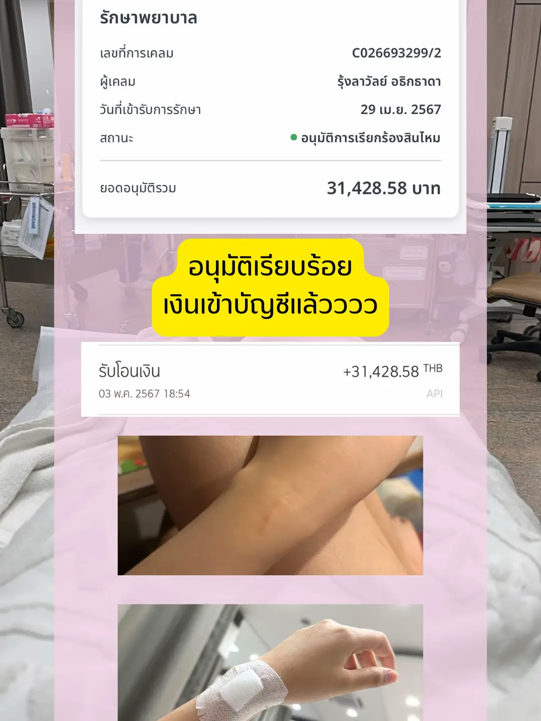 รีวิวไม่เจ็บตัวฟรีอีกต่อไป แกลเลอรีที่โพสต์โดย ลูกปลาaia Lemon8