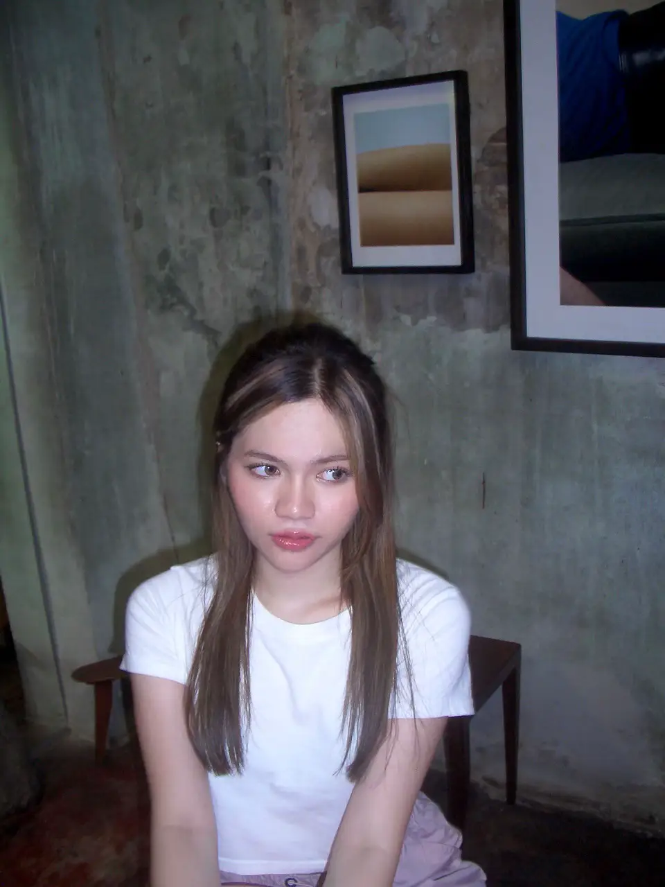 ฉีดปากครั้งแรก ความเจ็บระดับไหน⭐️⭐️⭐️ | แกลเลอรีที่โพสต์โดย Porsche ...